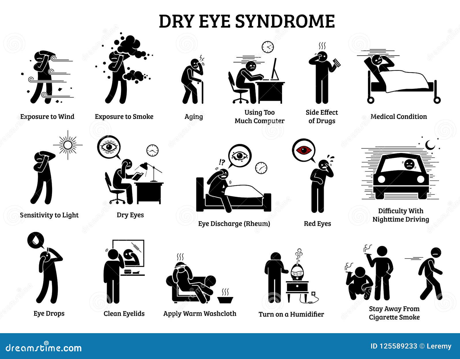 Syndrome d'oeil sec illustration de vecteur. Illustration du ...