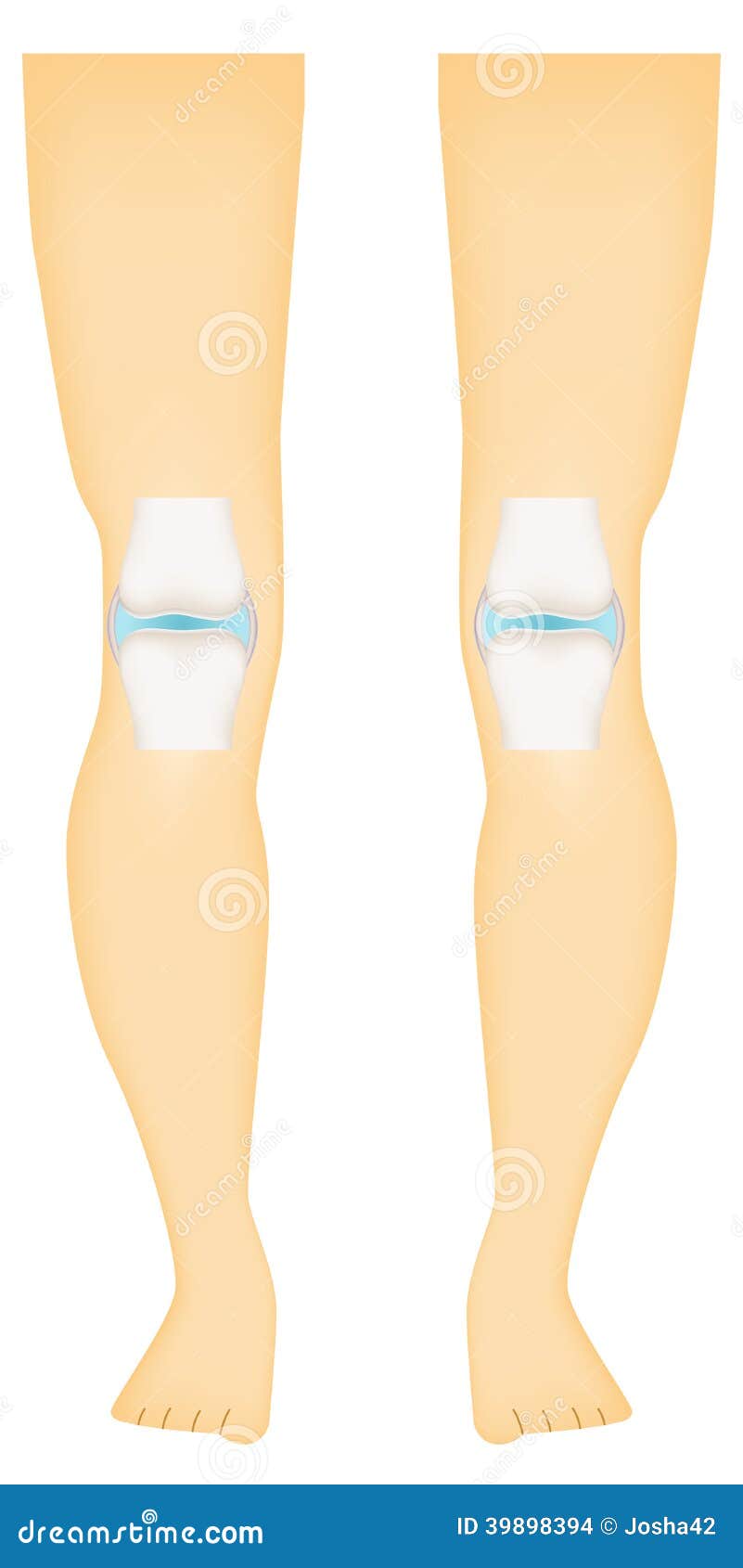 Synovial Knee Joint in Situ Stock Vector - Illustration of health ...