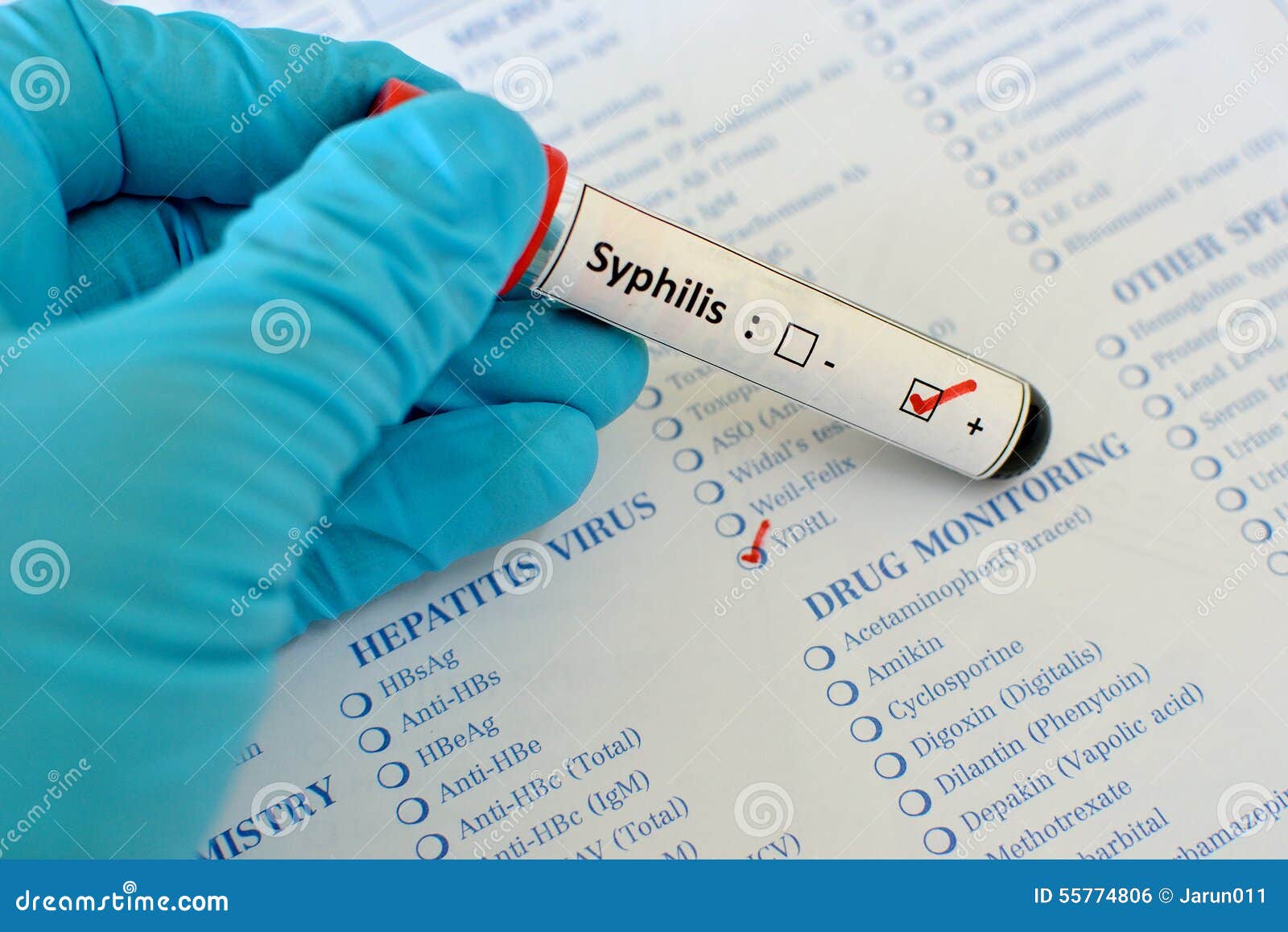 Syphilis positive stock photo. Image of patient, syphilis - 55774806