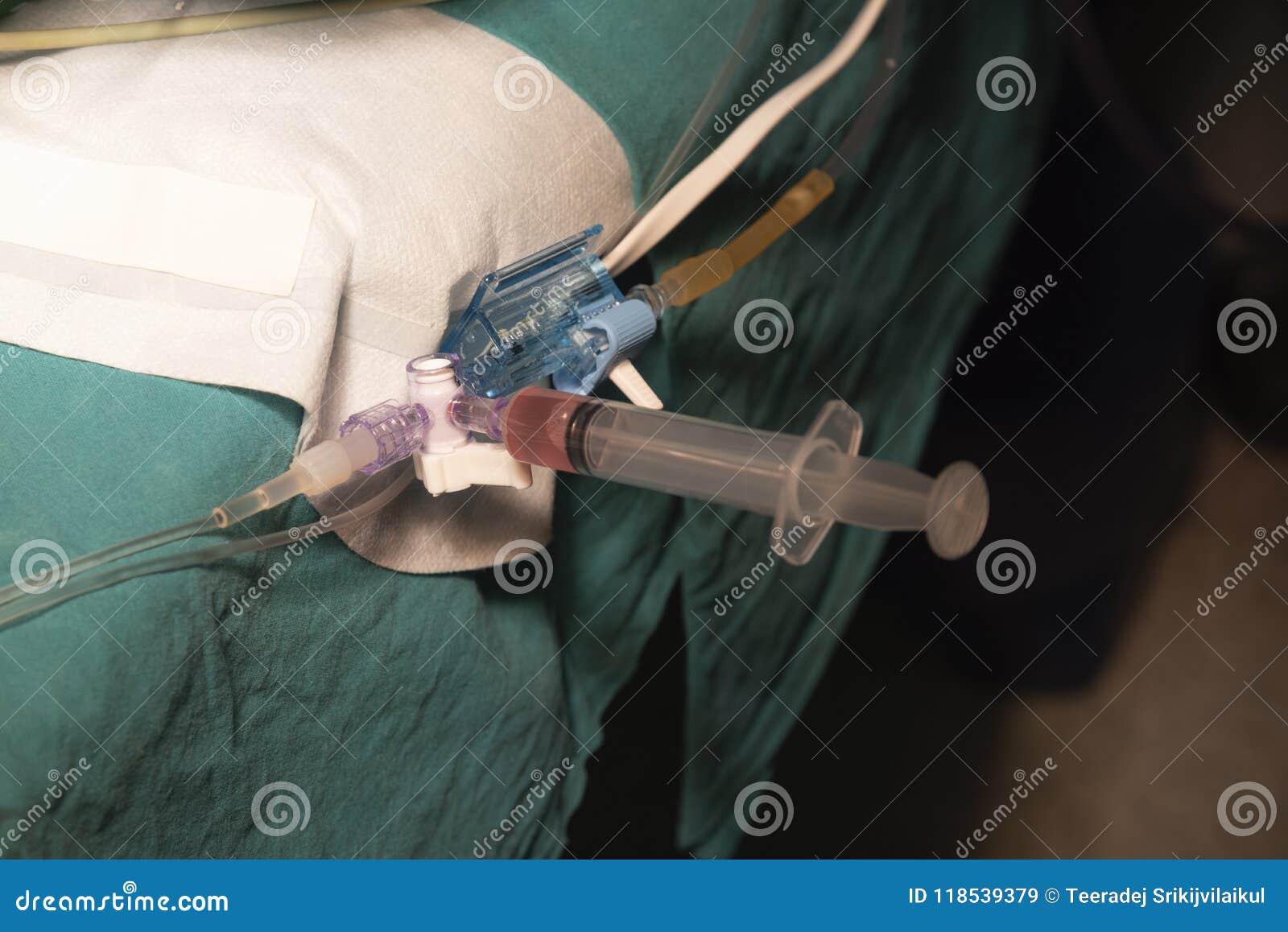 A Syringe on a Connector in Operating Room Stock Image - Image of ...