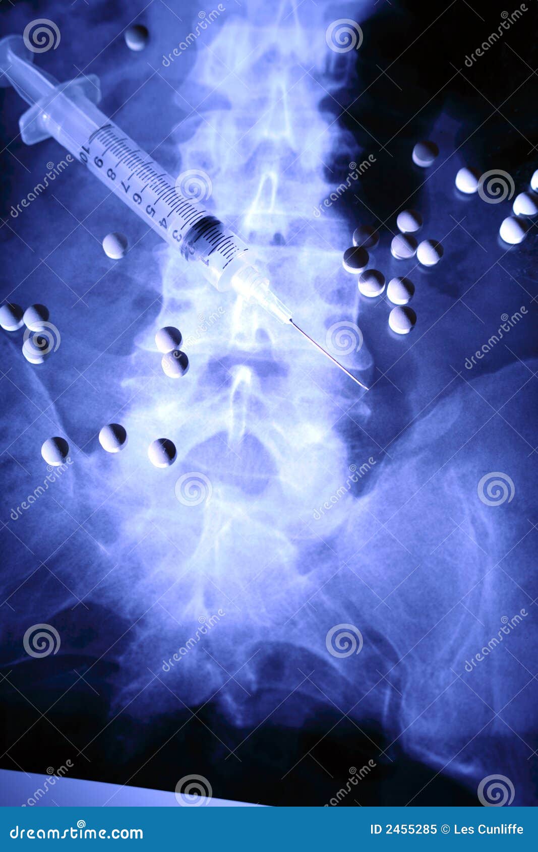 Syringe and Pillls on X-ray Stock Image - Image of medicine, colour ...