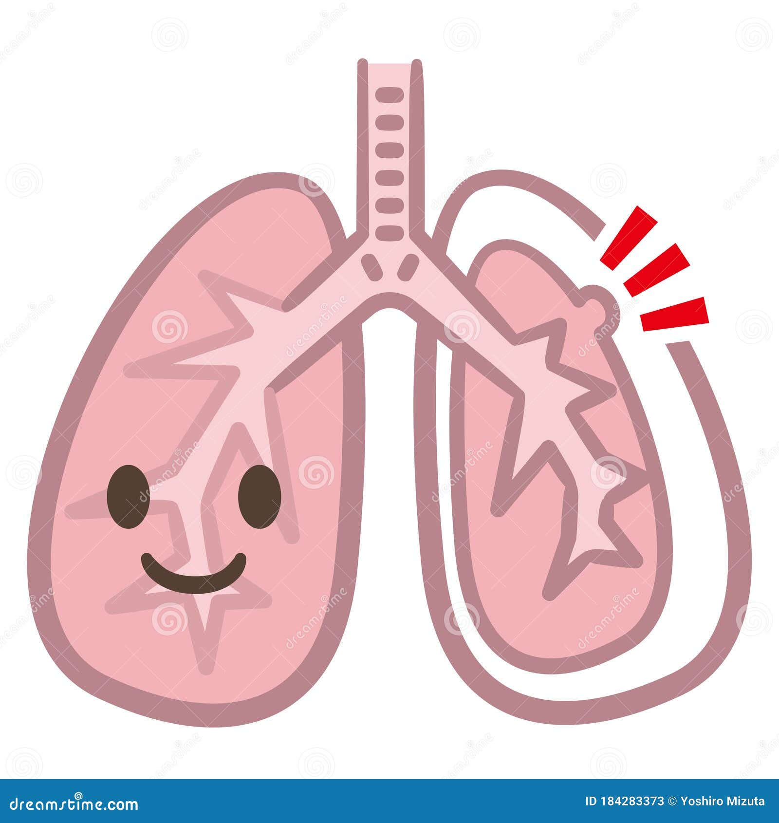 Síntomas Del Vector Pulmonar Del Neumotórax Ilustración del Vector ... Síntomas Del Vector Pulmonar Del Neumotórax Ilustración del Vector ...