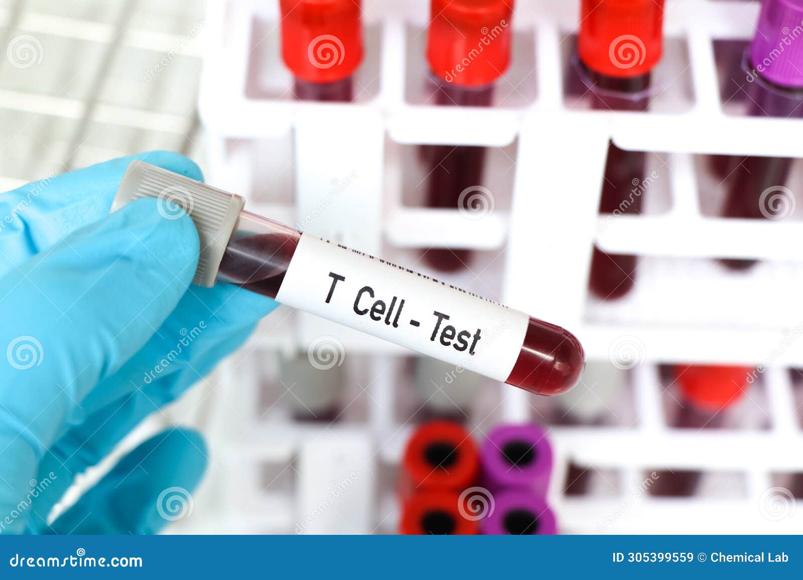 T Cell - Test, Blood Sample To Analyze in the Laboratory Stock Image ...
