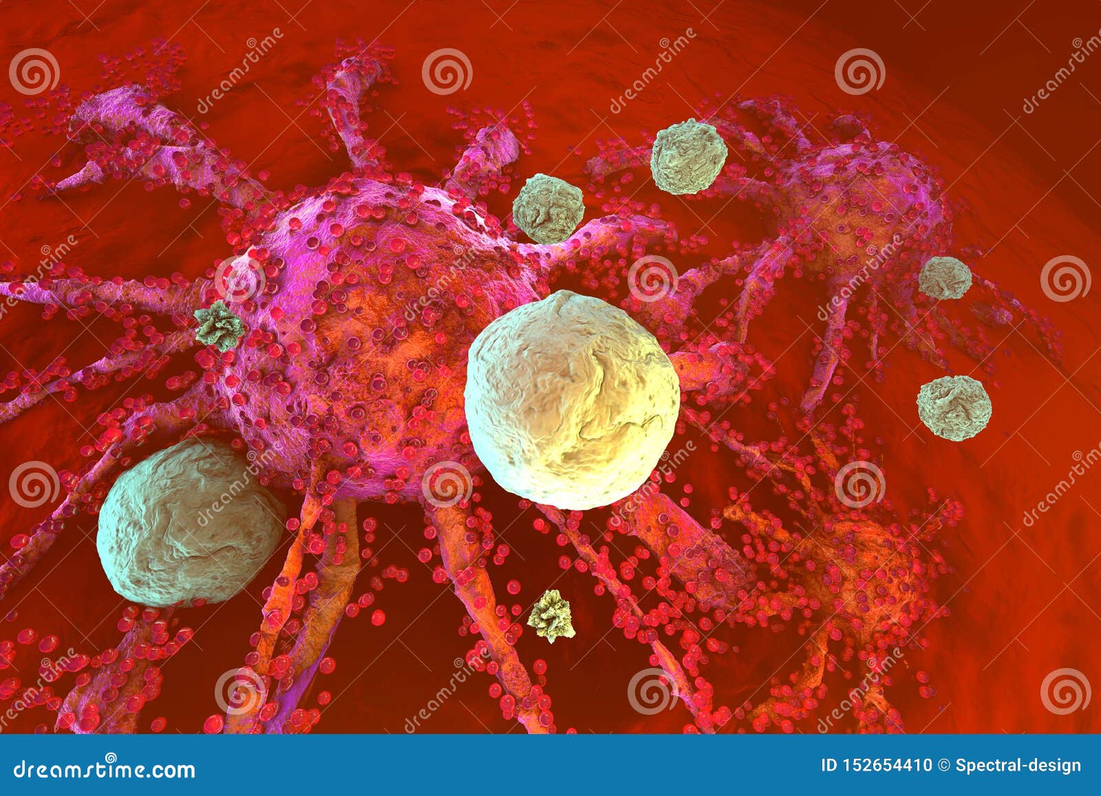 T-Cells of the Immune System Attacking Growing Cancer Cells Stock ...