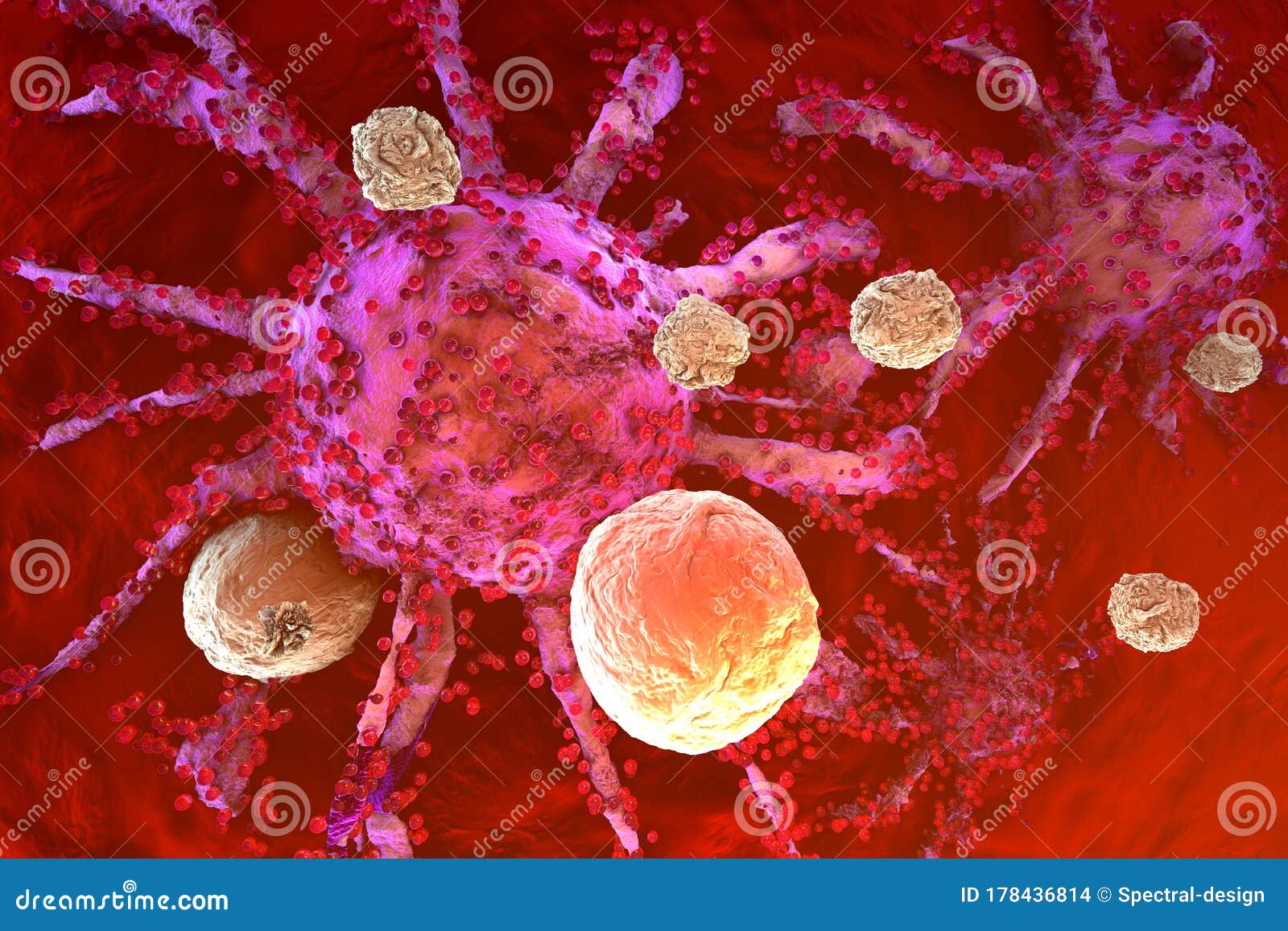 T-Cells of the Immune System Attacking Growing Cancer Cells Stock ...