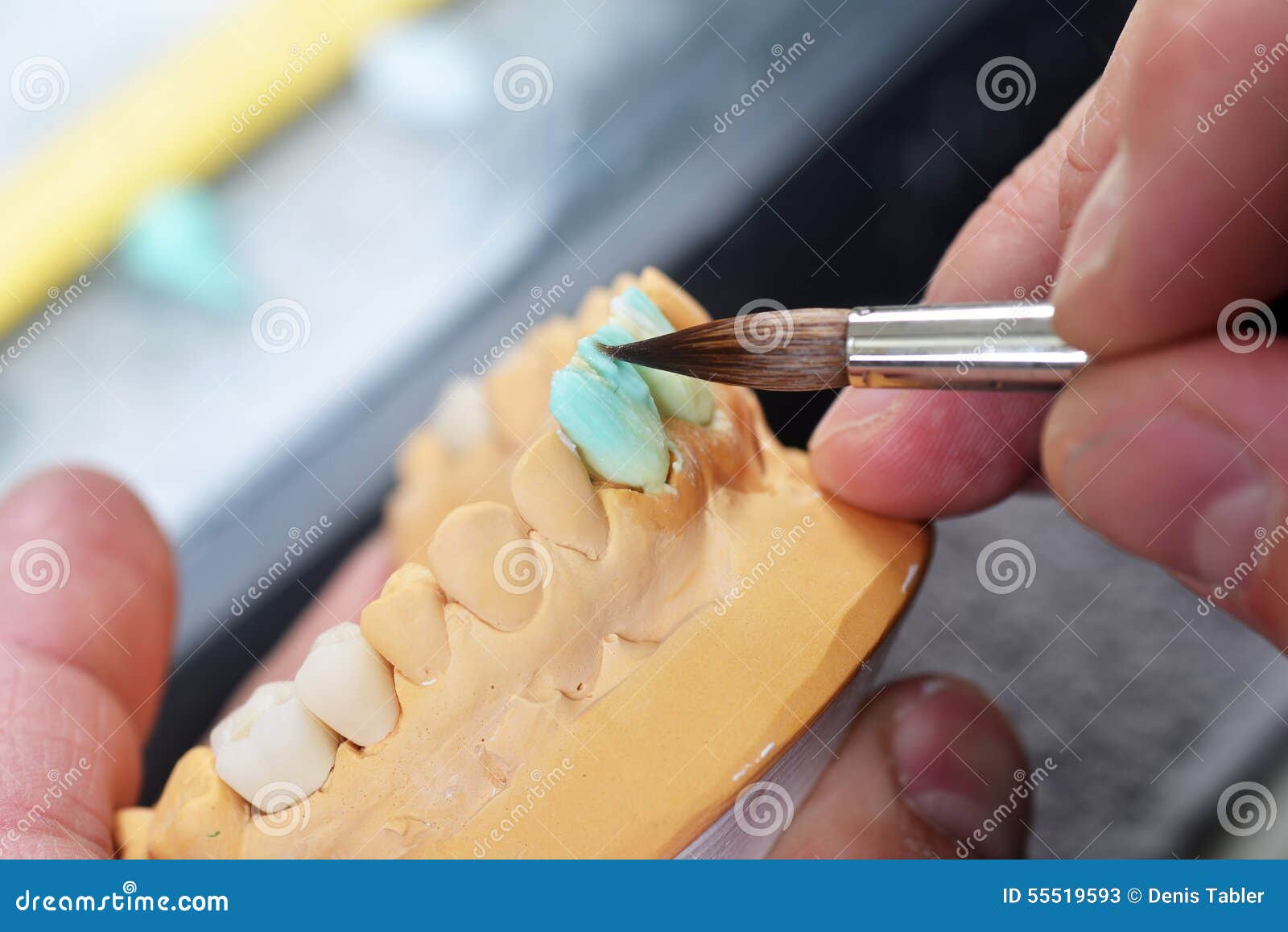 Table with dental tools stock image. Image of orthodontics - 55519593