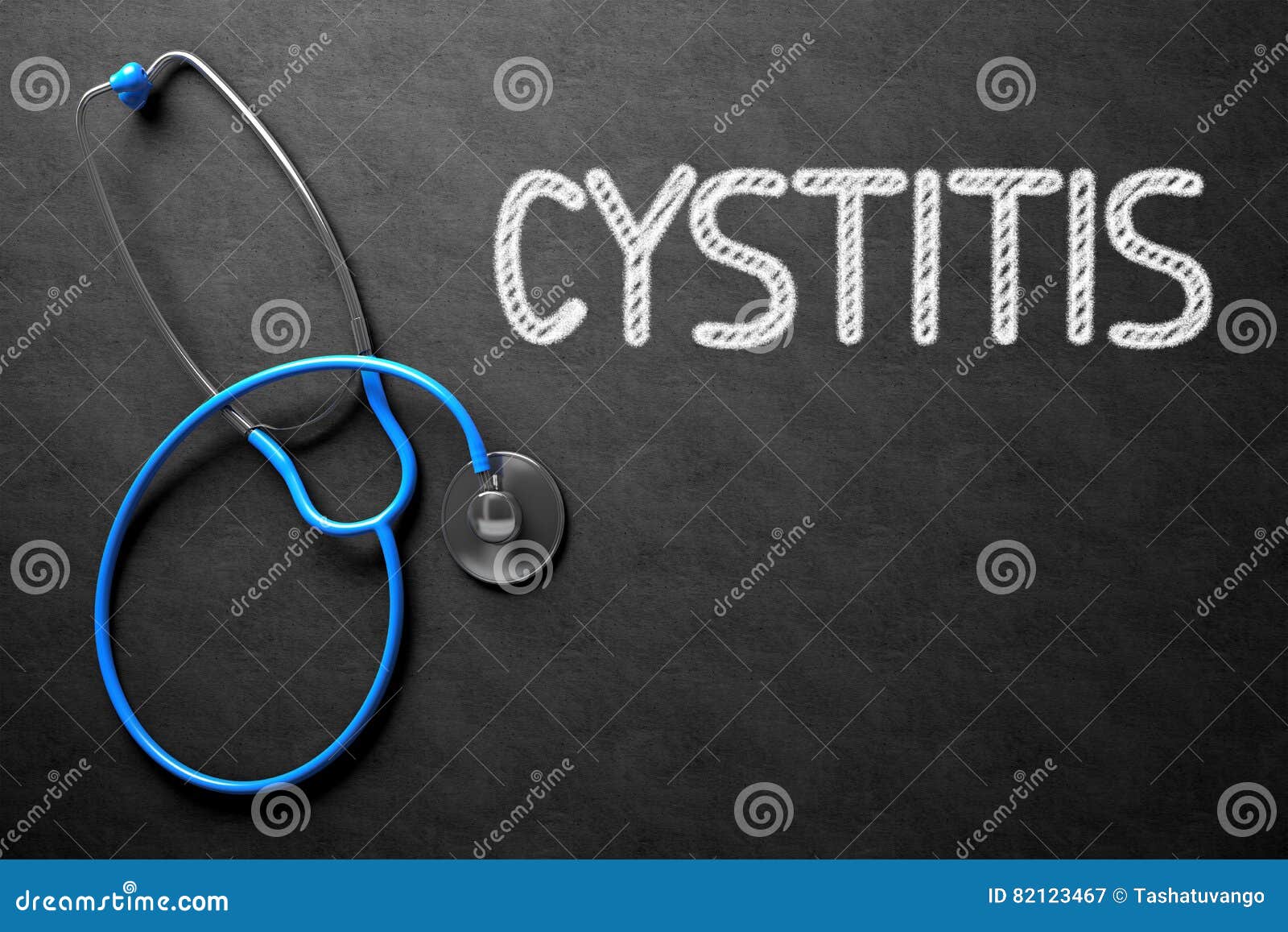 Tableau Avec Le Concept De Cystite Illustration 3D Illustration Stock ...