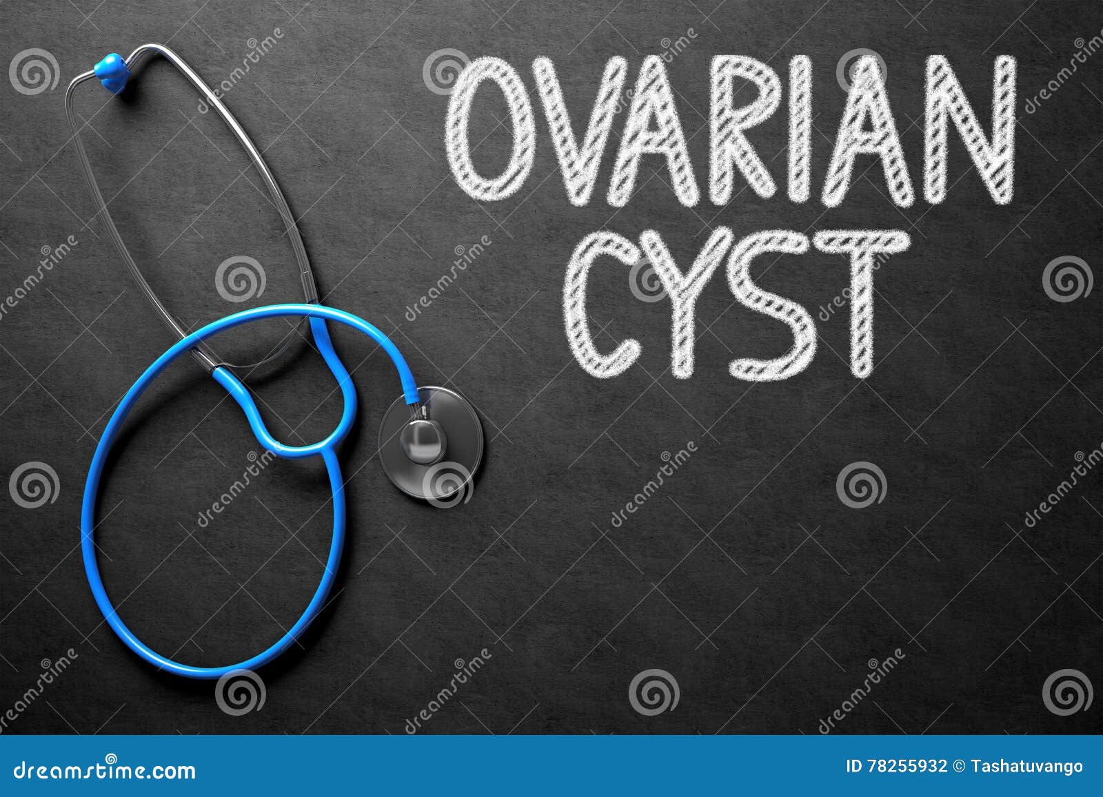 Tableau Avec Le Concept De Kyste Ovarien Illustration 3D Photo stock ...