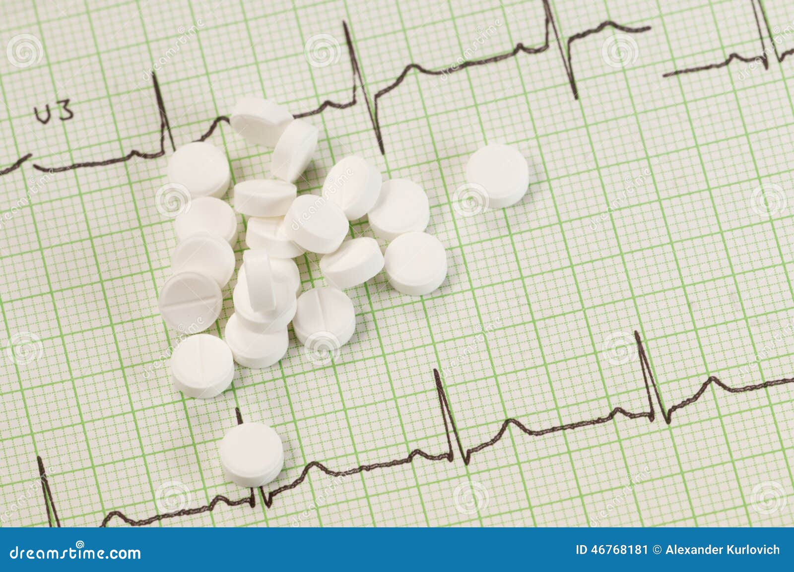 Tablets on Electrocardiogram Stock Image - Image of diagnostic, chart ...