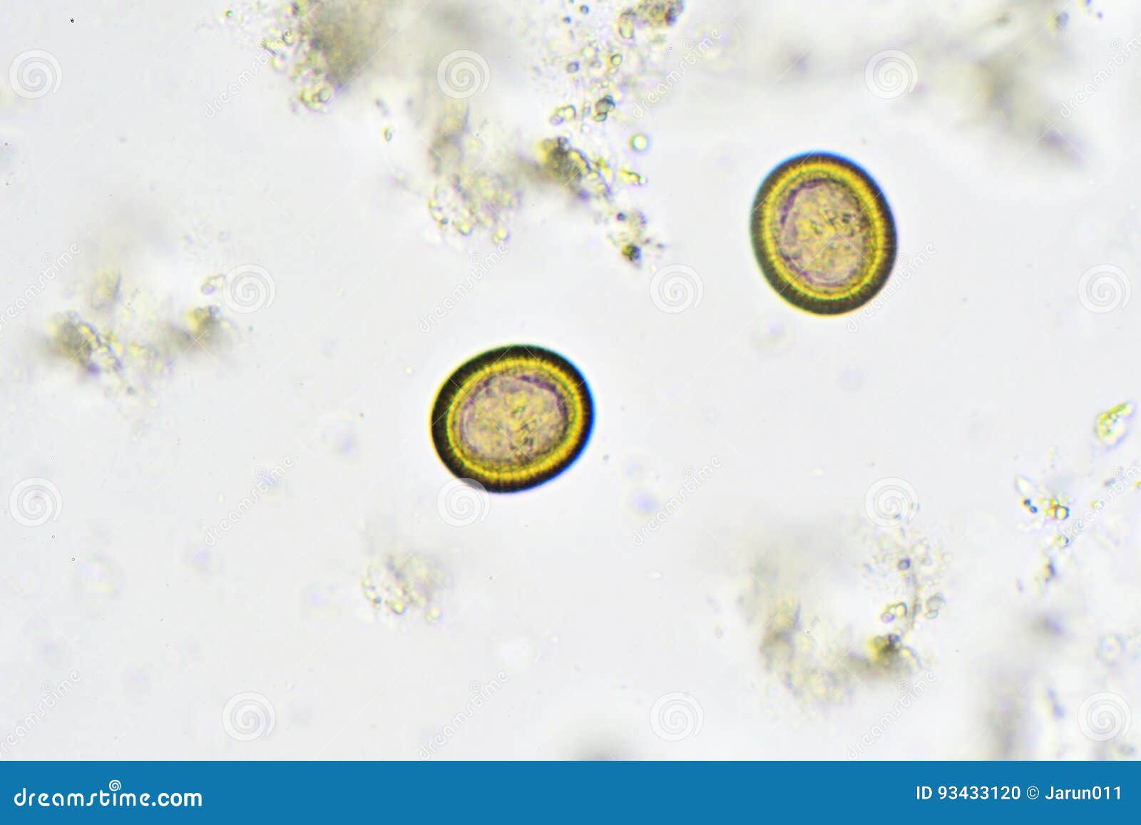 Taenia eggs stock photo. Image of helminthology, taeniasis - 93433120
