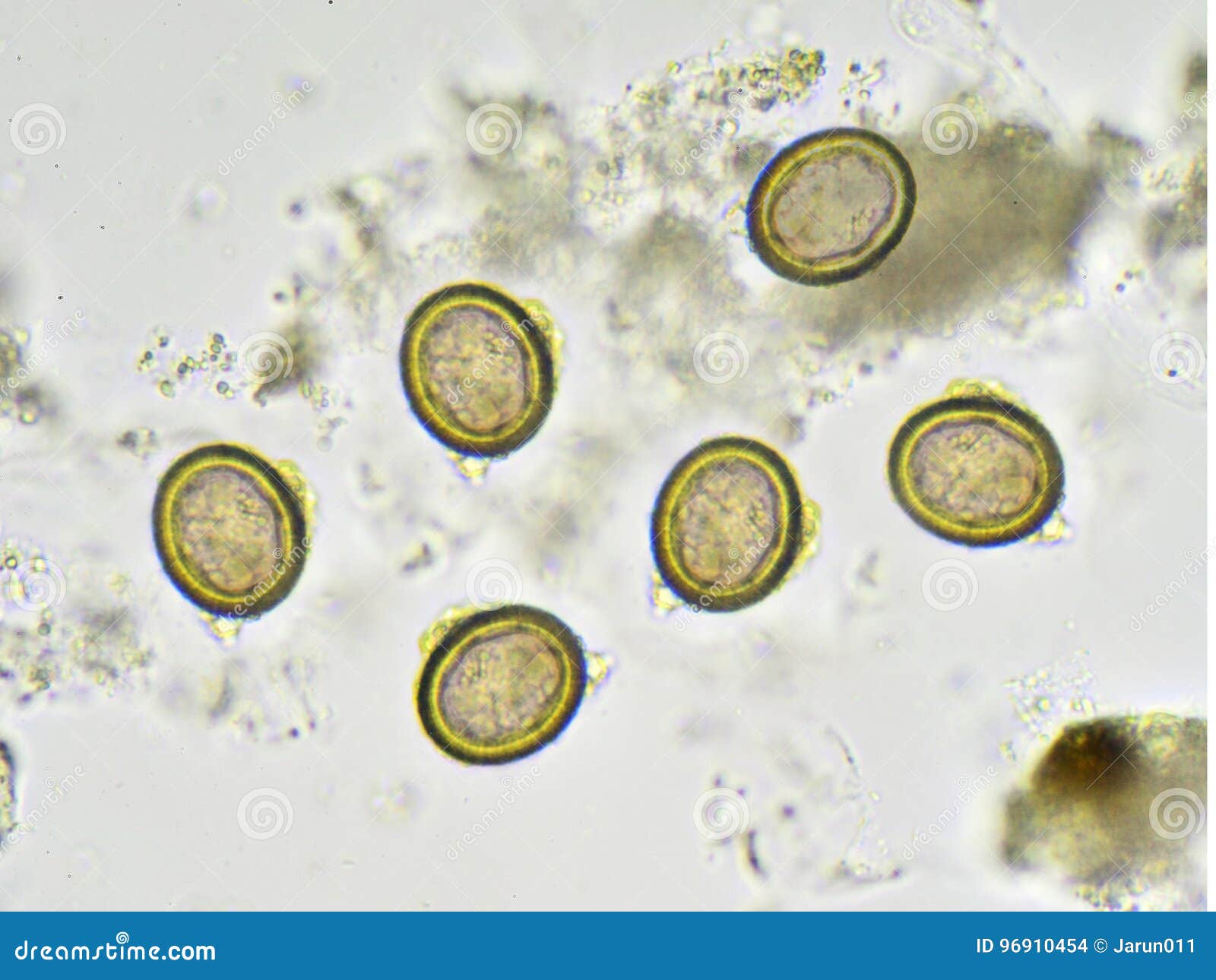 Taenia in stool stock photo. Image of disease, taenia - 96910454