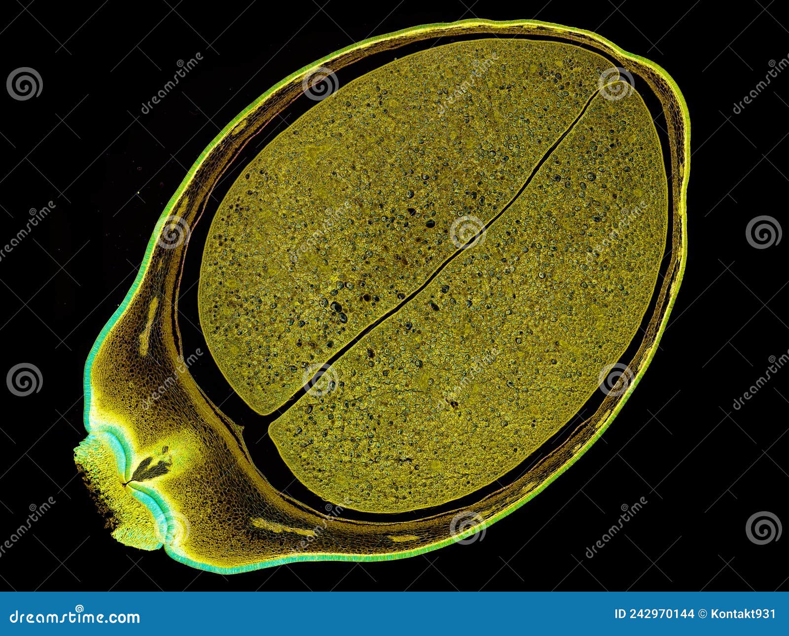 Plant Cells Under A Microscope Labeled