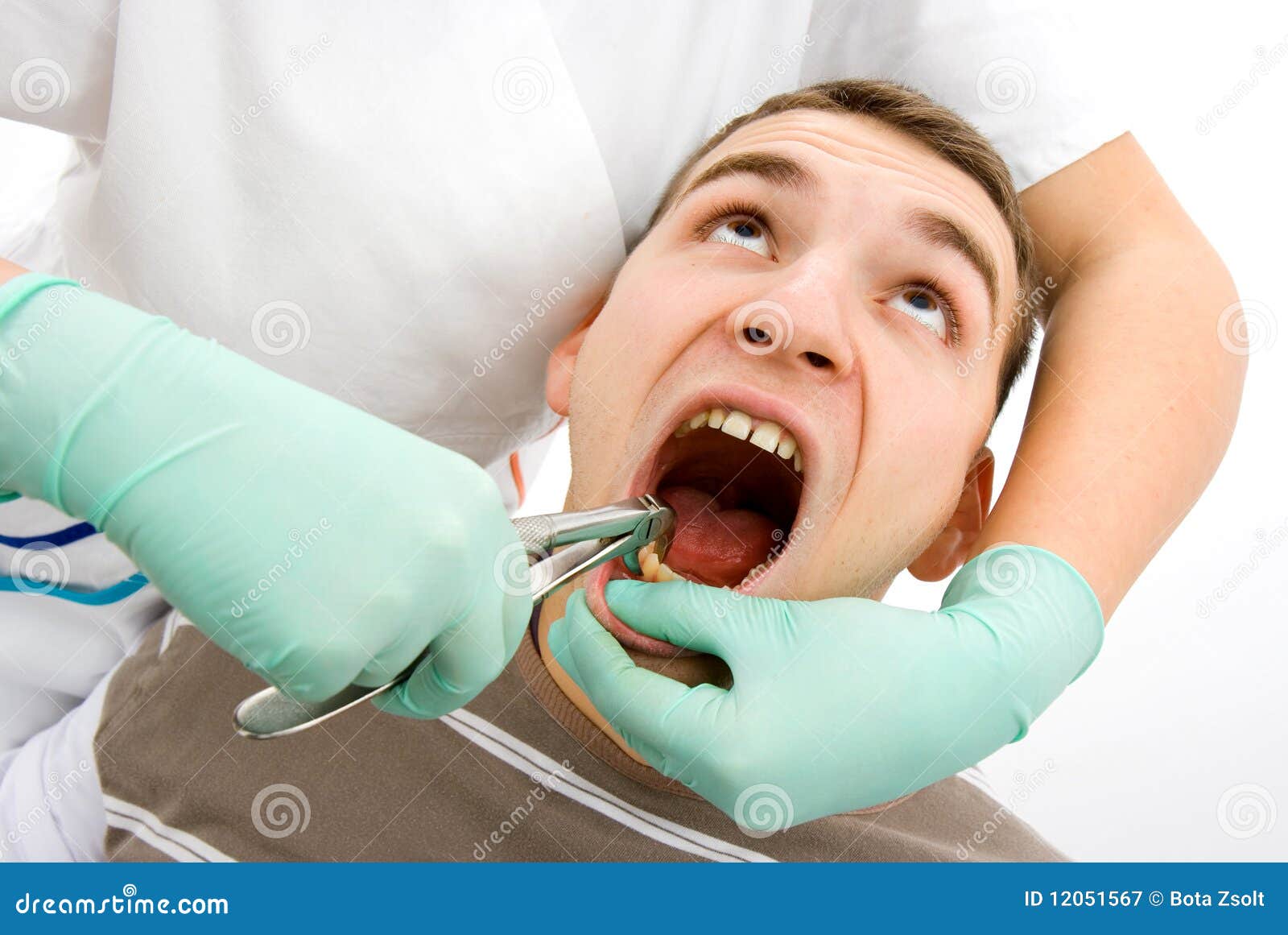 Tand- extraktion fotografering för bildbyråer. Bild av kalender - 12051567