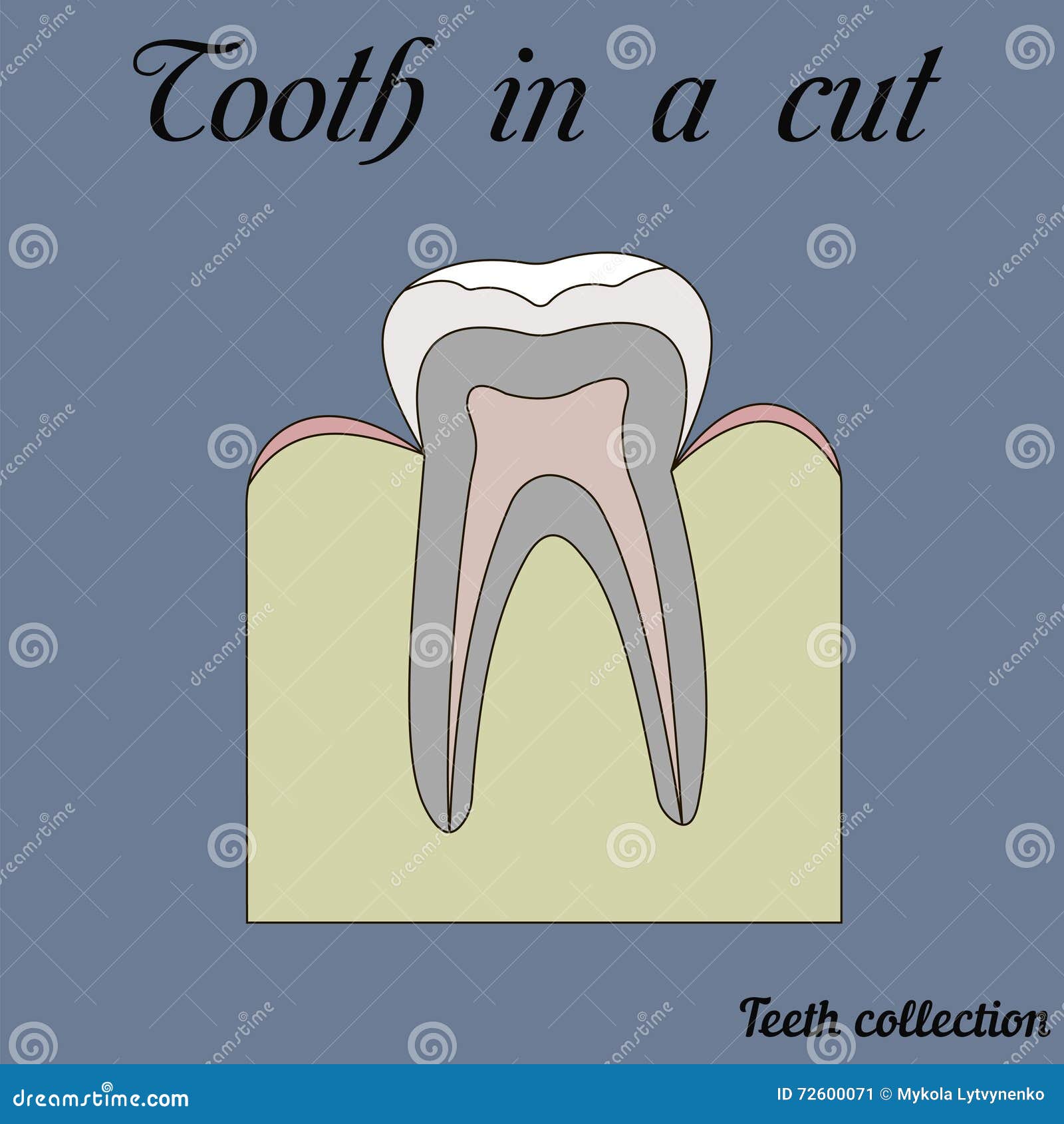Tand i ett snitt vektor illustrationer. Illustration av plakat - 72600071