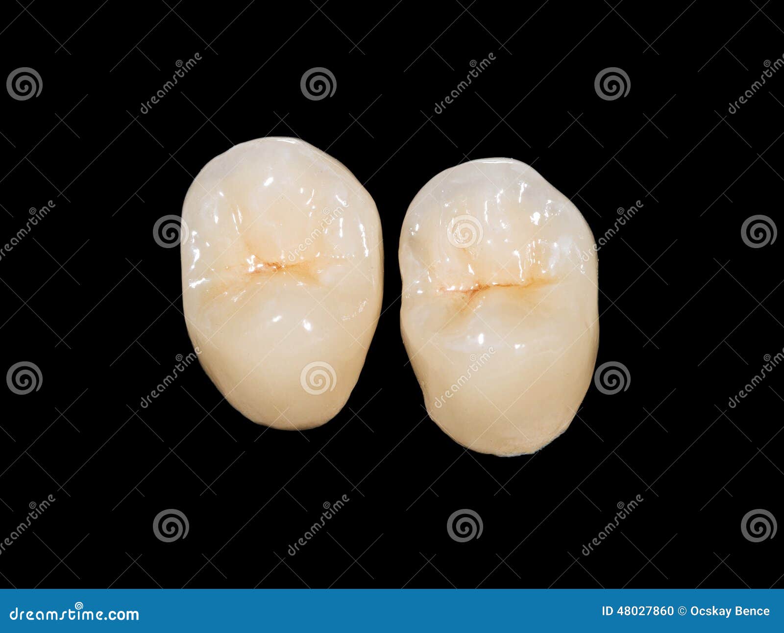 Tand- keramiska kronor arkivfoto. Bild av isolerat, porslin - 48027860