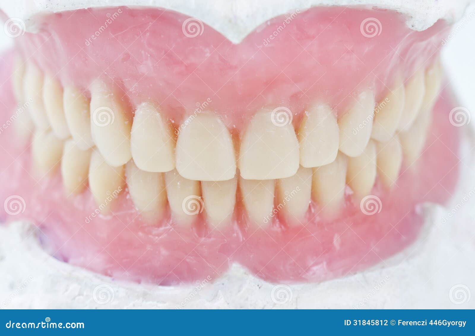 Tand totale wasprothese stock foto. Image of beet, gebit - 31845812