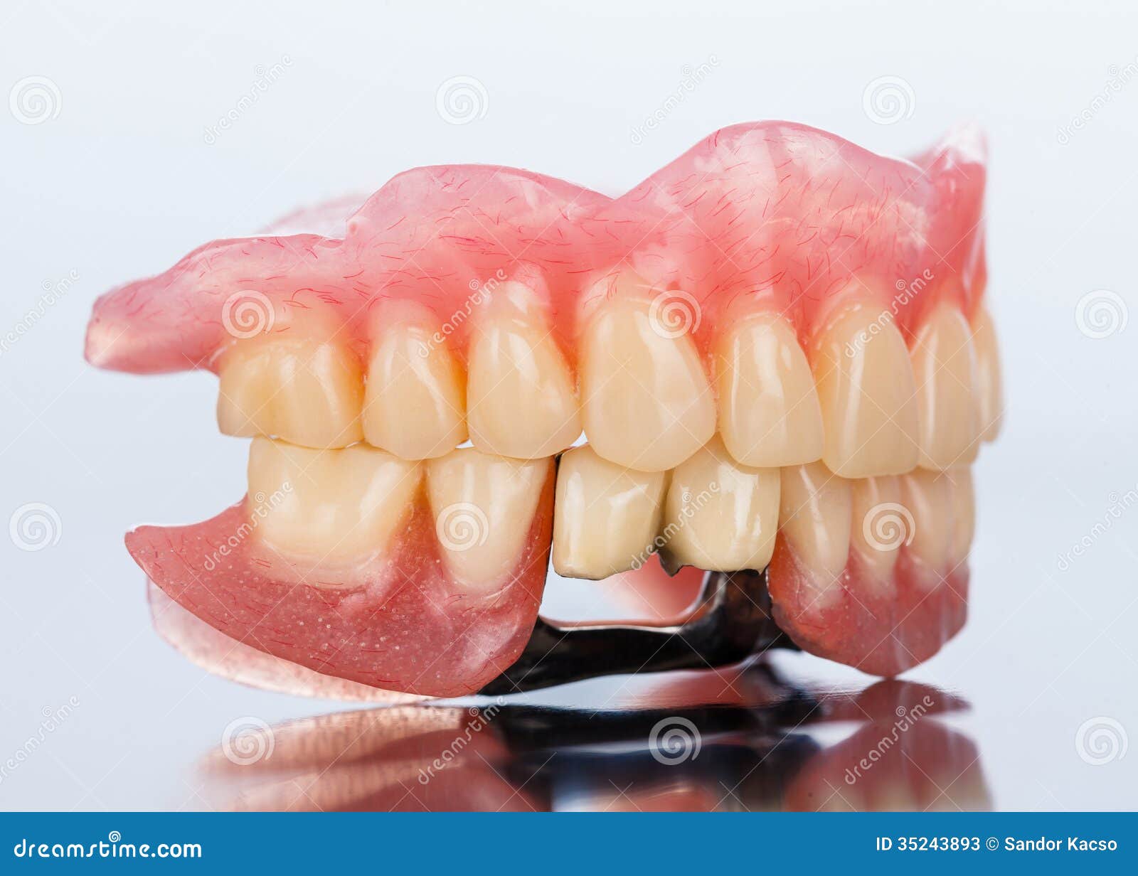 Tandprothese - zijaanzicht stock afbeelding. Image of gezondheid - 35243893