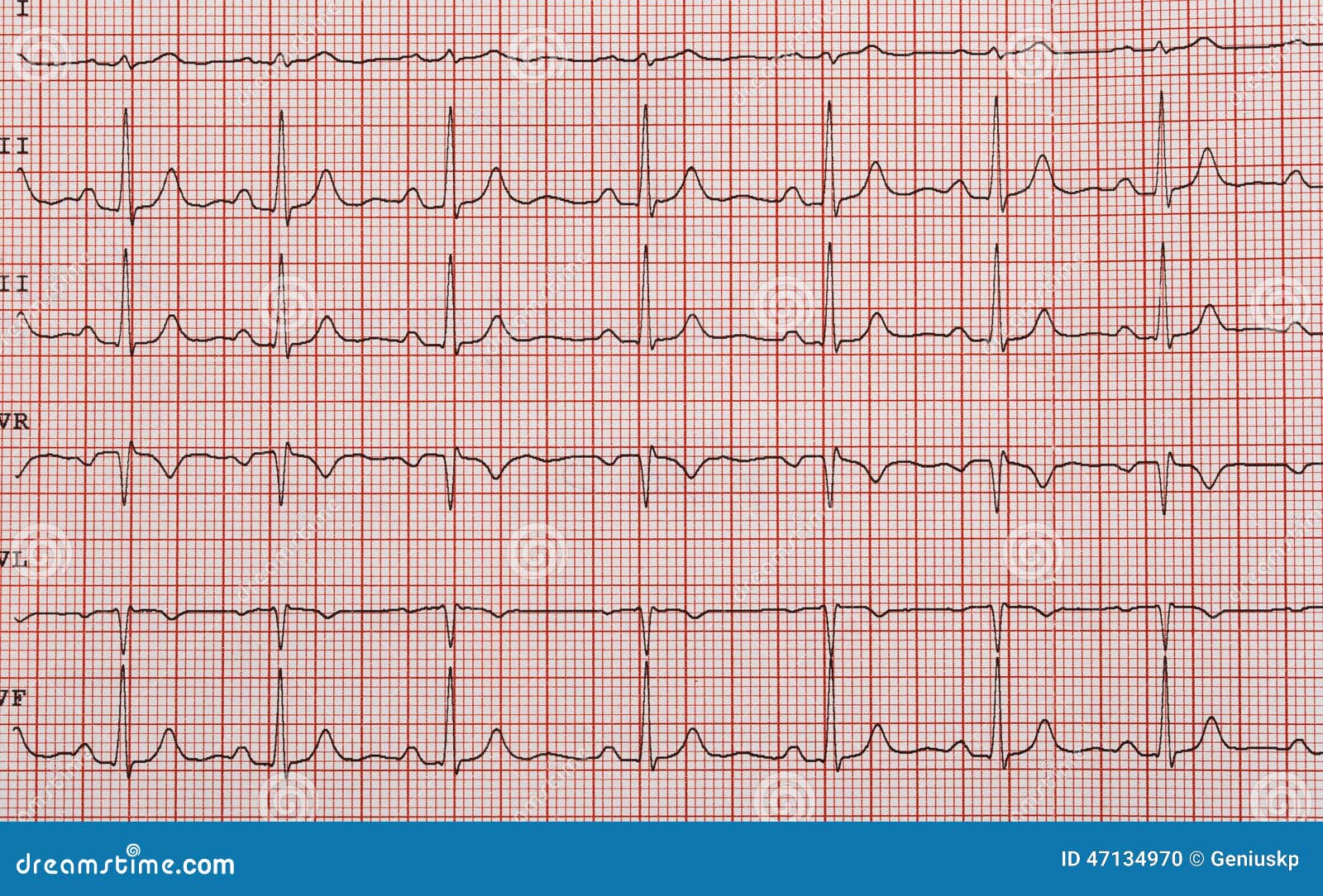 Tape with the cardiogram stock photo. Image of amplitude - 47134970