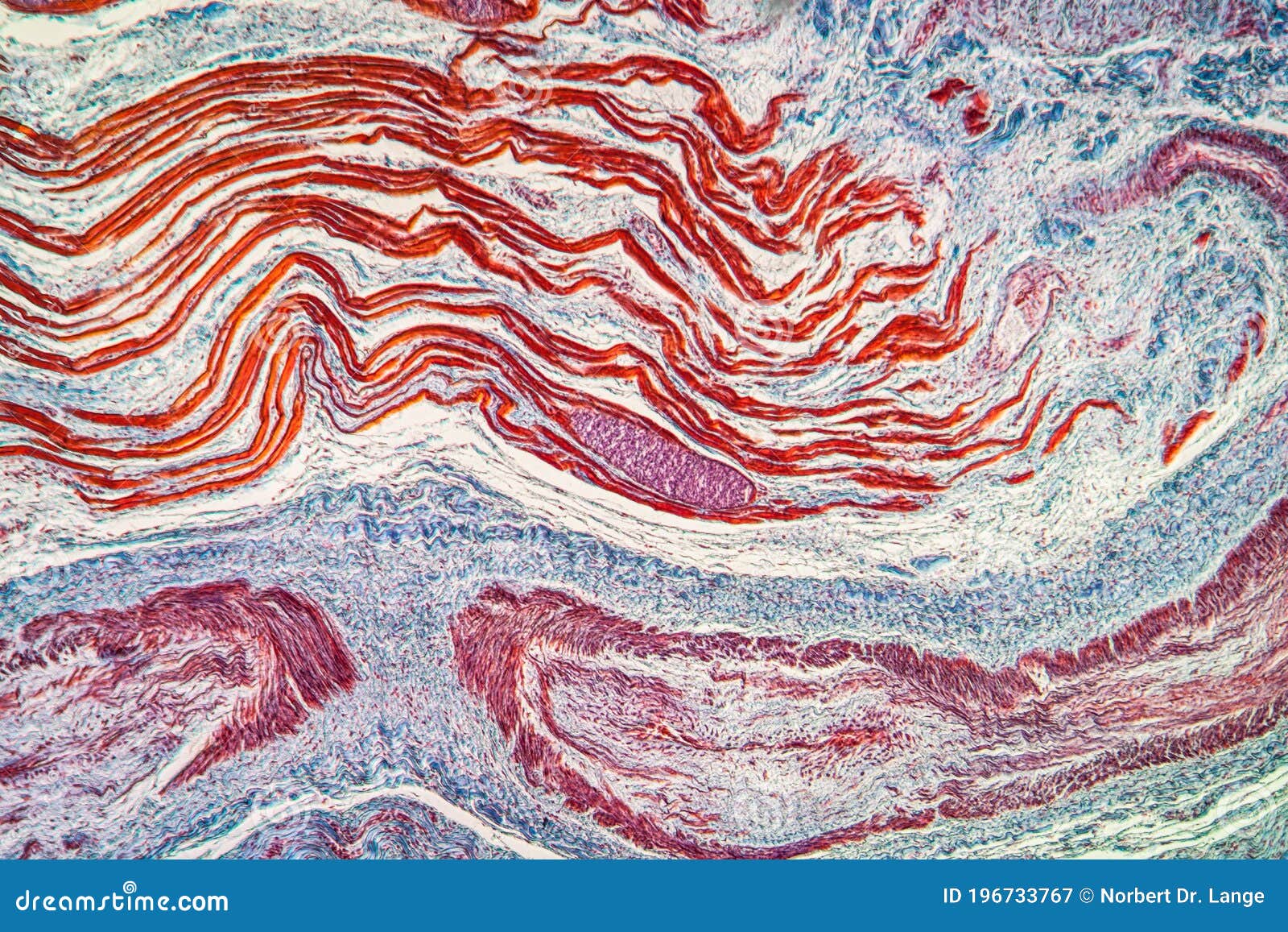 Tapeworm Fin Parasite in Muscle Stock Image - Image of science ...