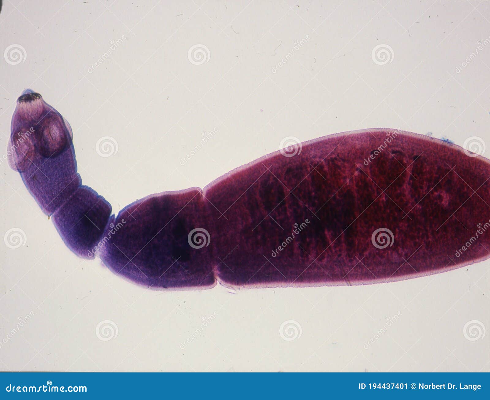 Tapeworm With Segments And Suction Cups Royalty-Free Stock Photo ...