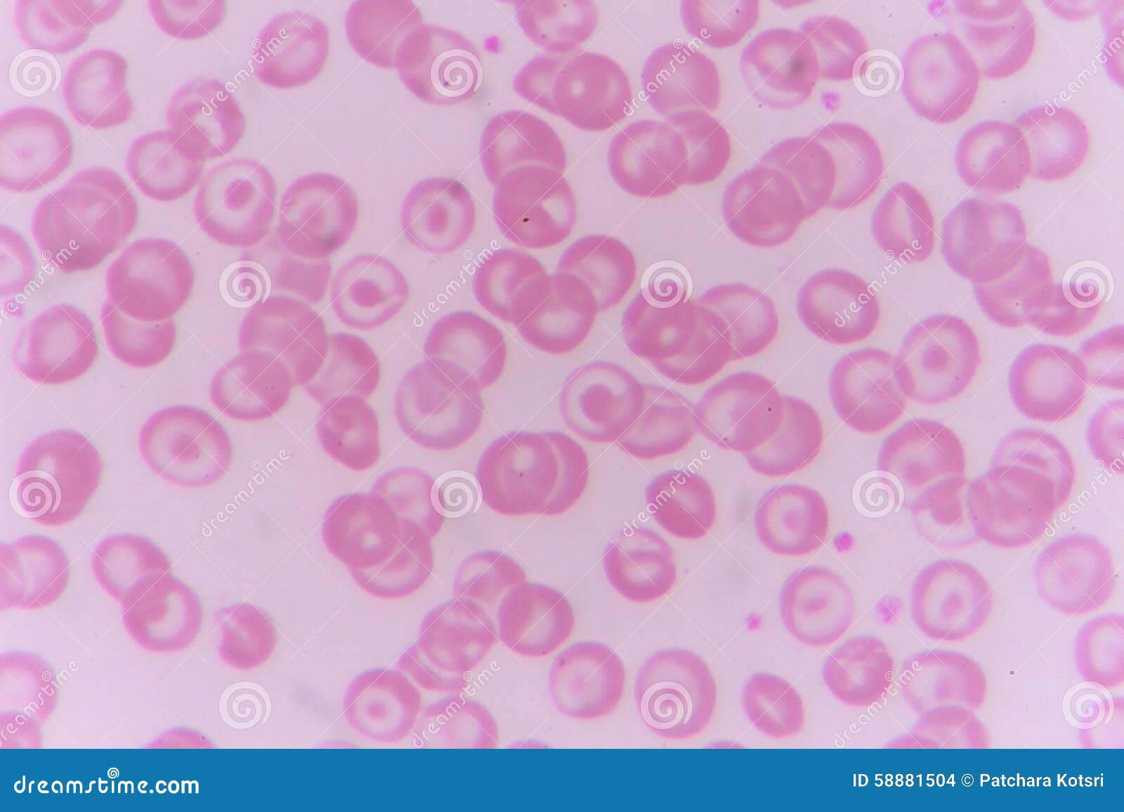 Target cell stock photo. Image of medicine, blood, health - 58881504