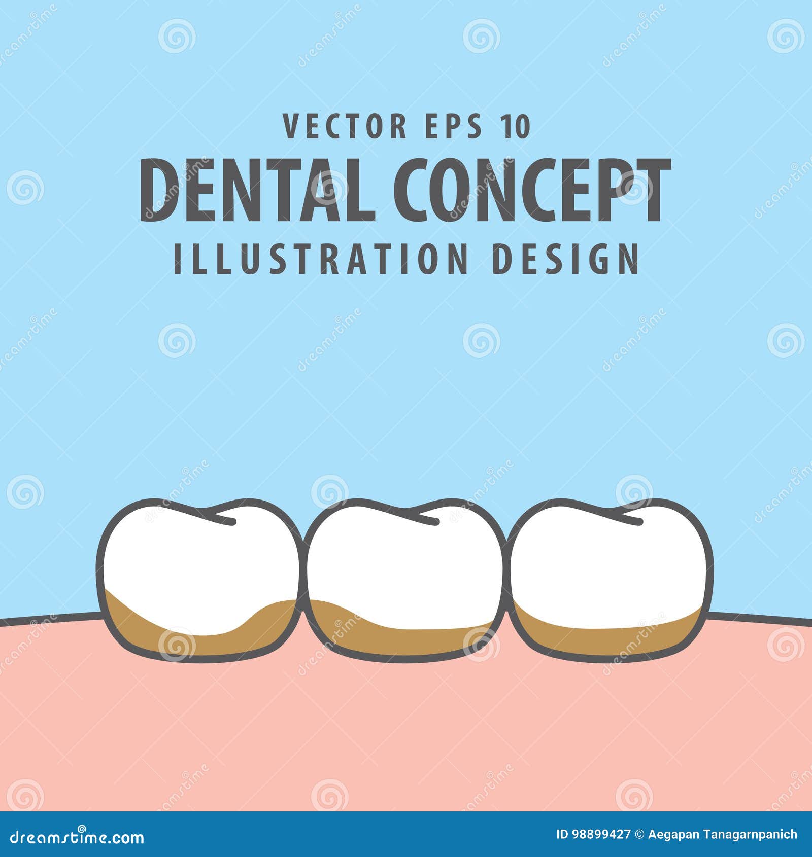 Calculus Teeth Cartoon, Dental Concept Vector Illustration ...