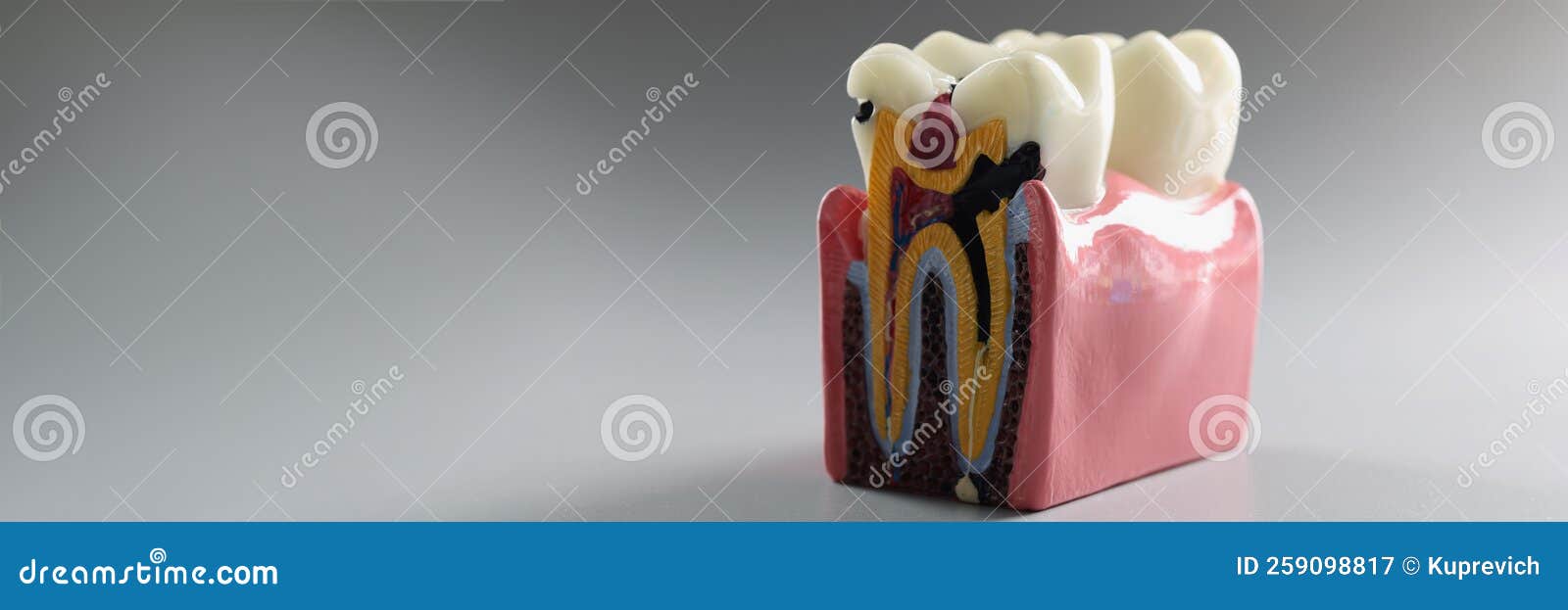 Teaching Model of a Tooth in Cross Section, Close-up Stock Image ...