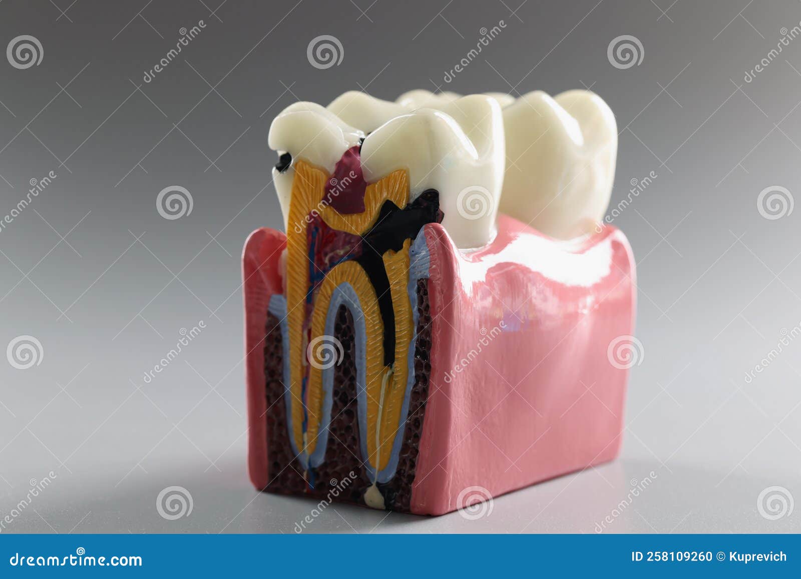Teaching Model of a Tooth in Cross Section, Close-up Stock Photo ...