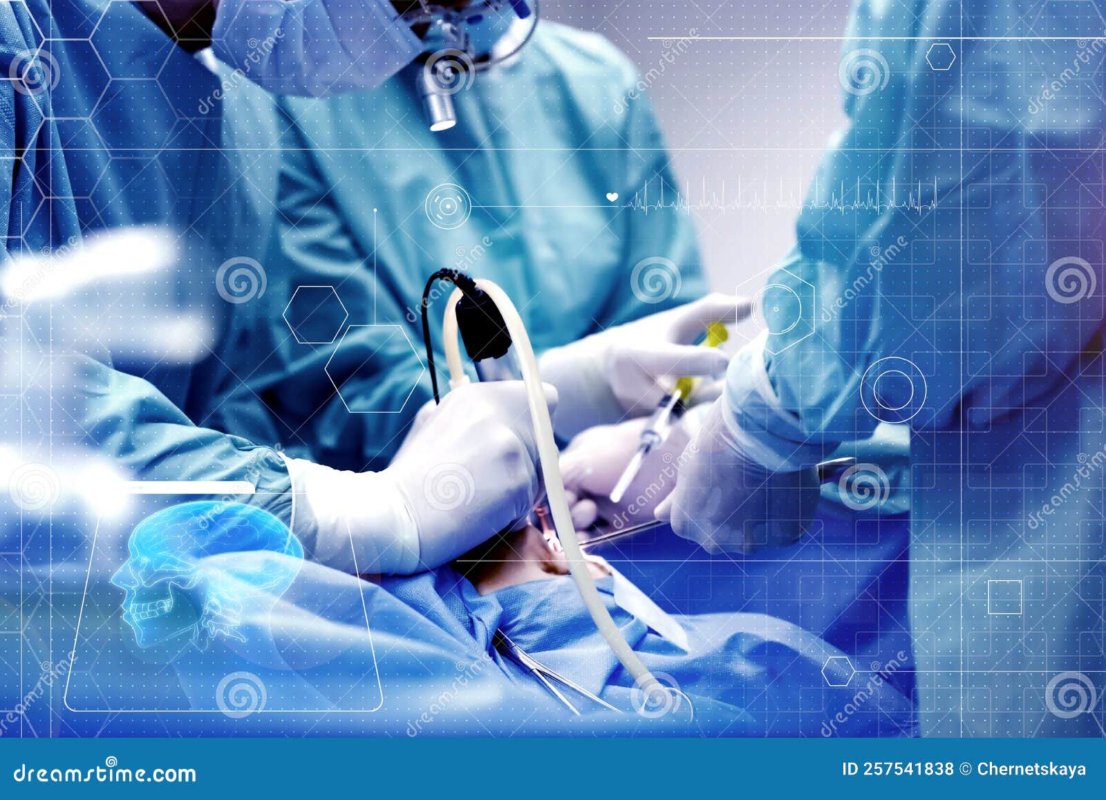 Team of Professional Doctors Performing Operation in Surgery Room and ...