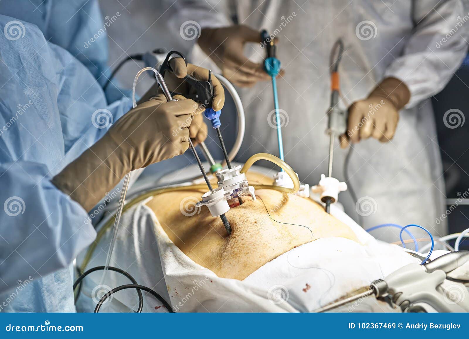 Laparoscopy Operation Process Stock Image - Image of illuminated ...