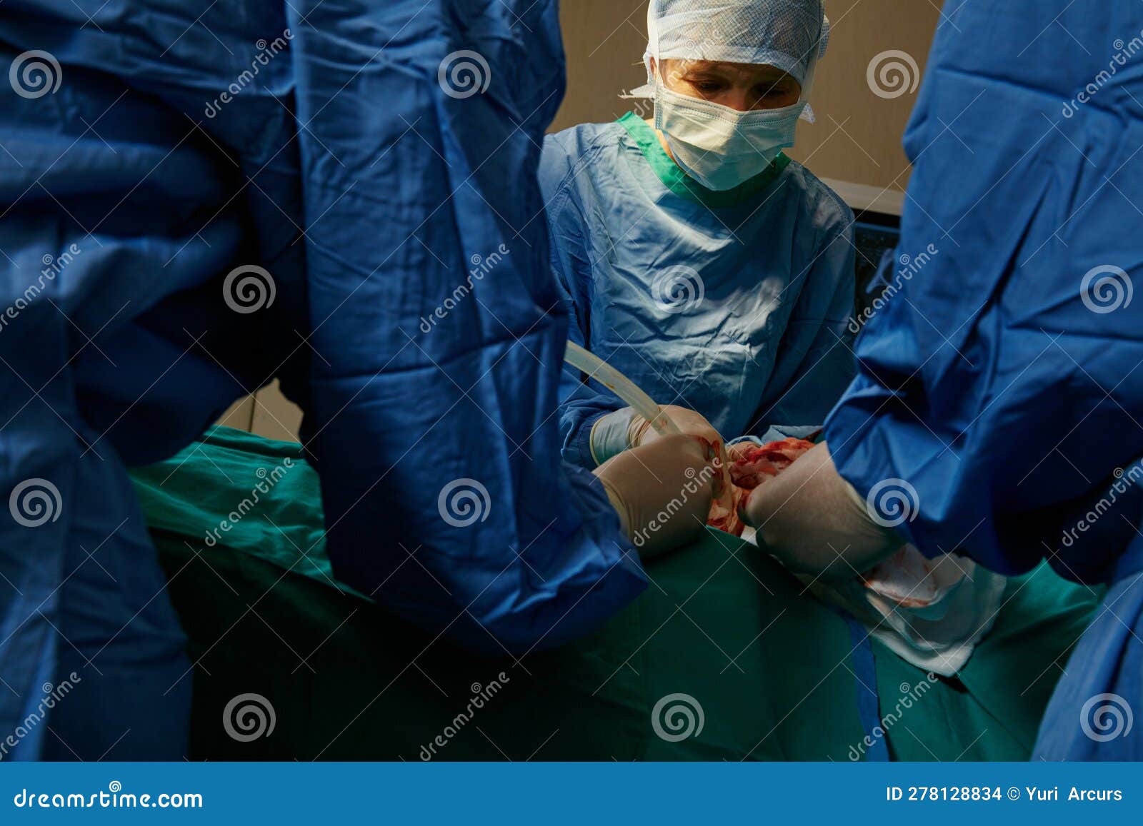 Teamwork is Essential for a Successful Surgery. a Team of Surgeons ...