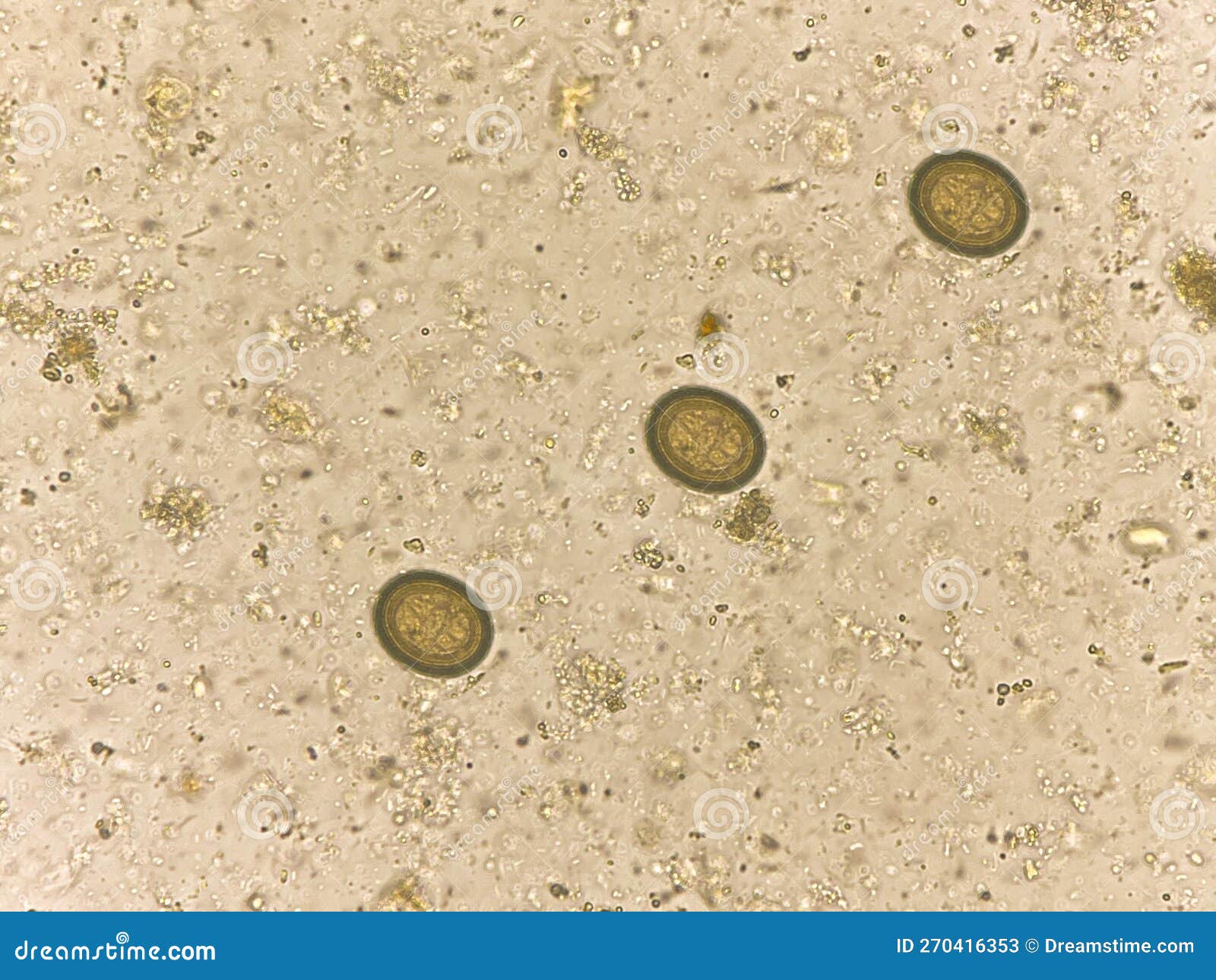 Teania Egg Human Parasite in Stool Stock Image - Image of infection ...