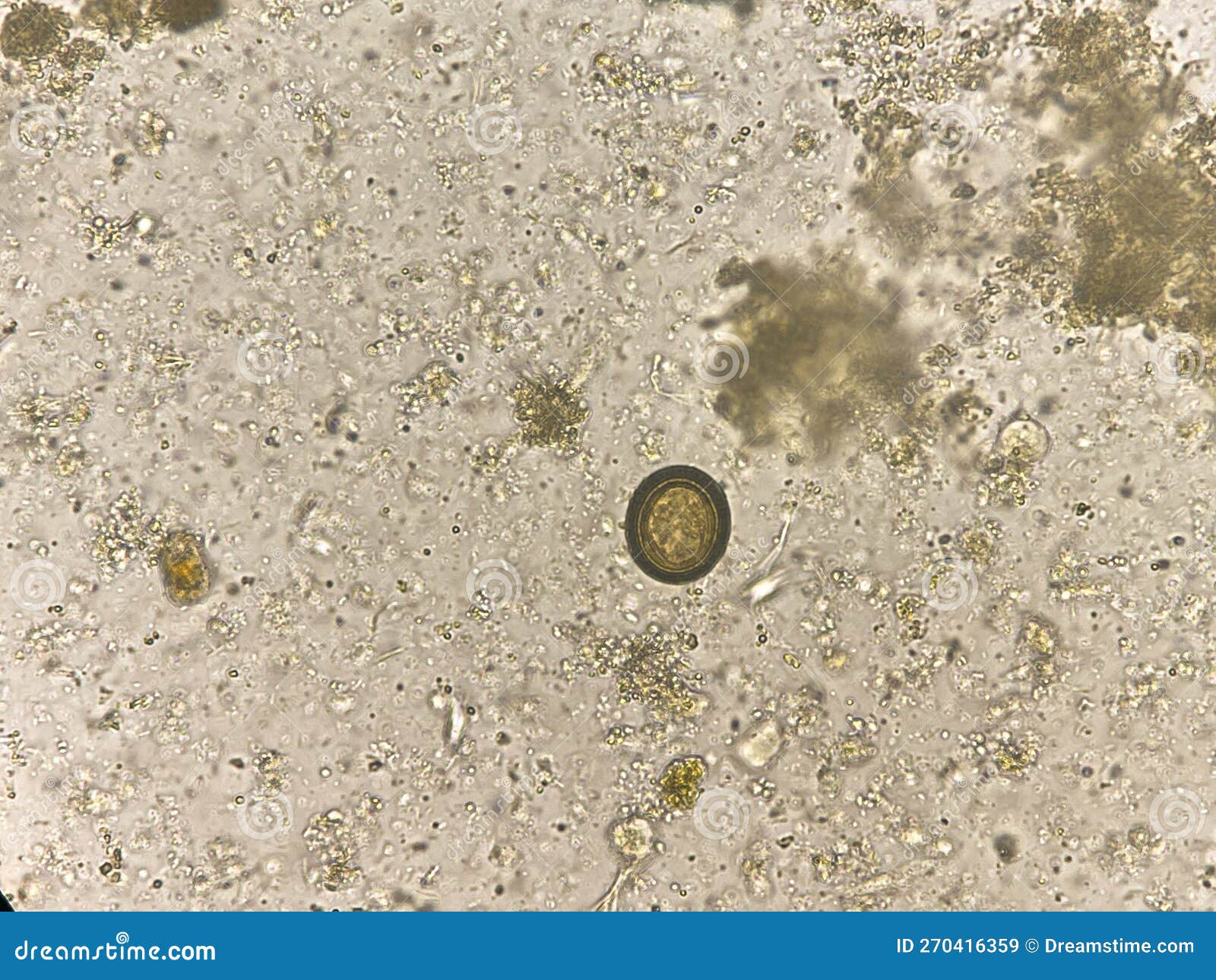 Teania Egg Human Parasite in Stool Stock Image - Image of nature ...