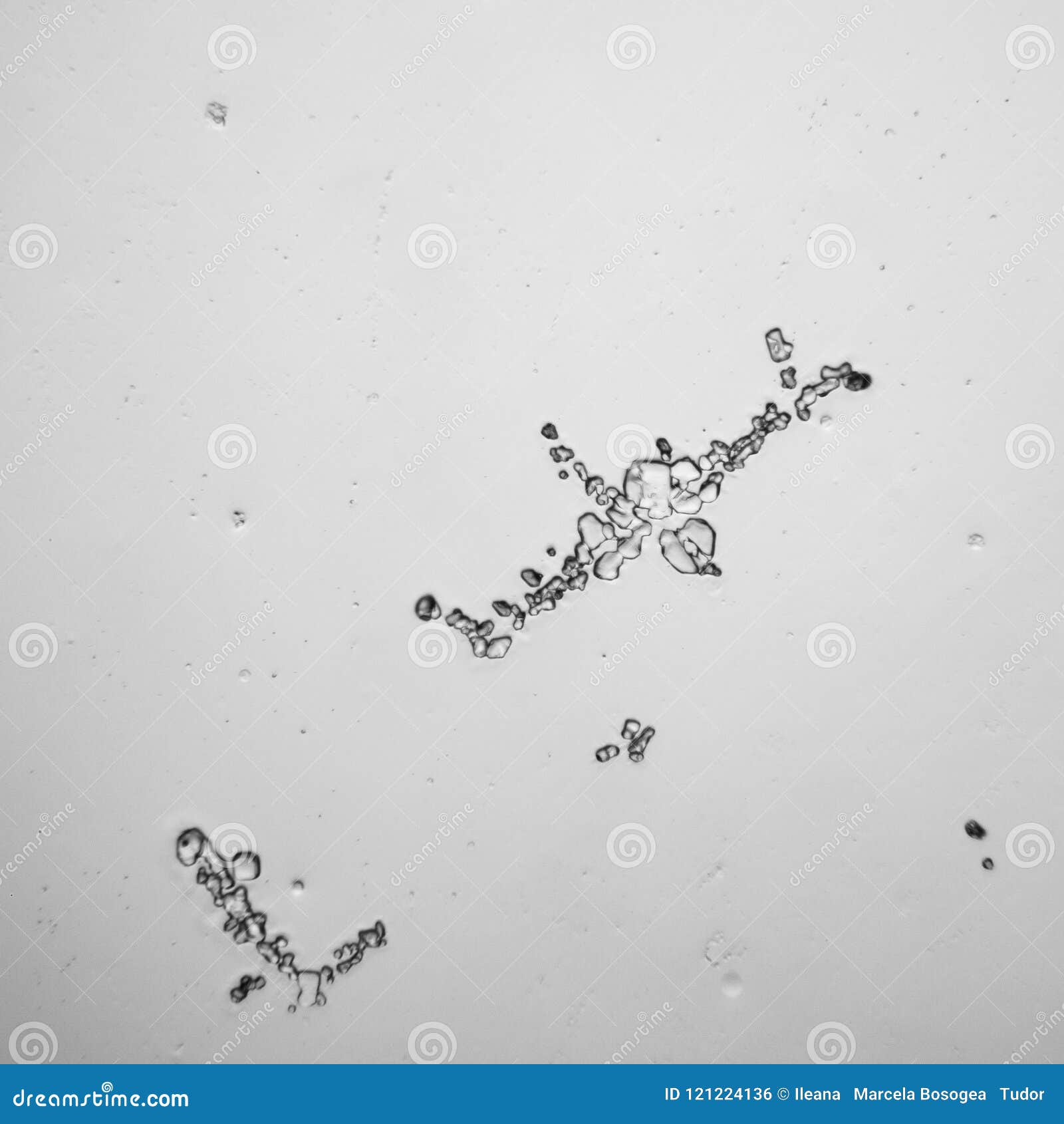 Tears Viewed at the Microscope Stock Photo - Image of health, medicine ...
