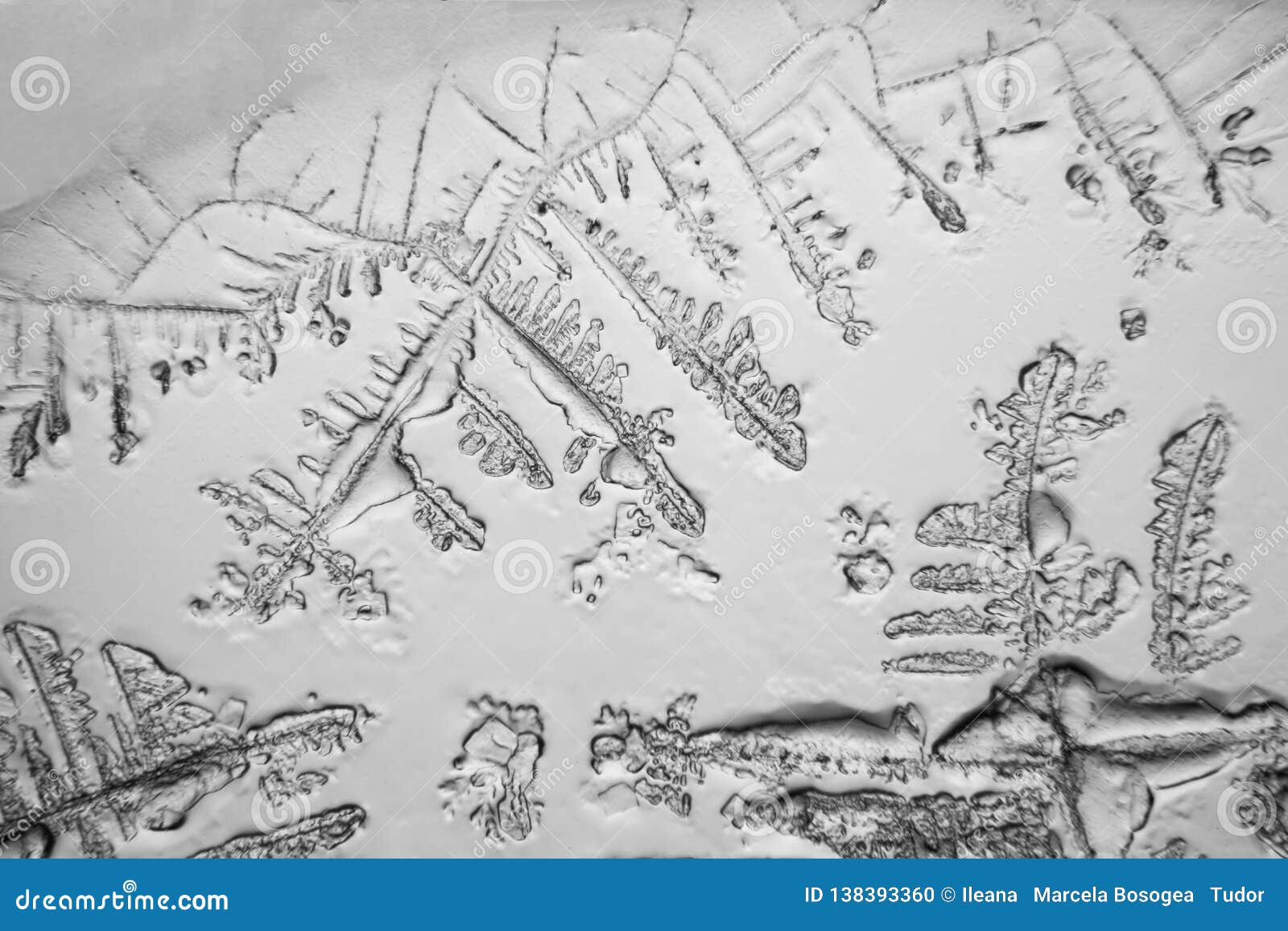 Tears Viewed at the Microscope Stock Photo - Image of sadness, pain ...