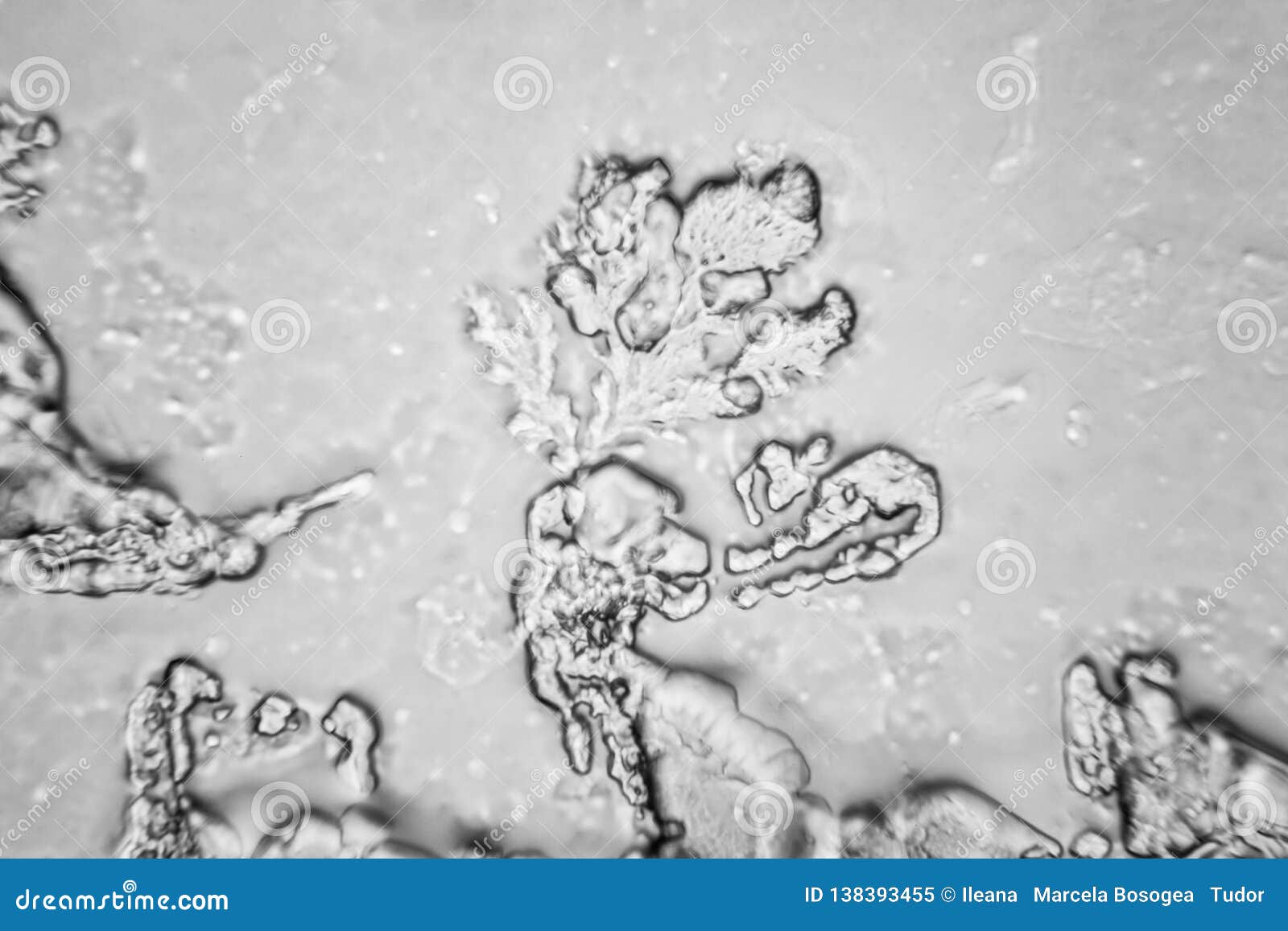 Tears Viewed at the Microscope Stock Image - Image of texture, slide ...