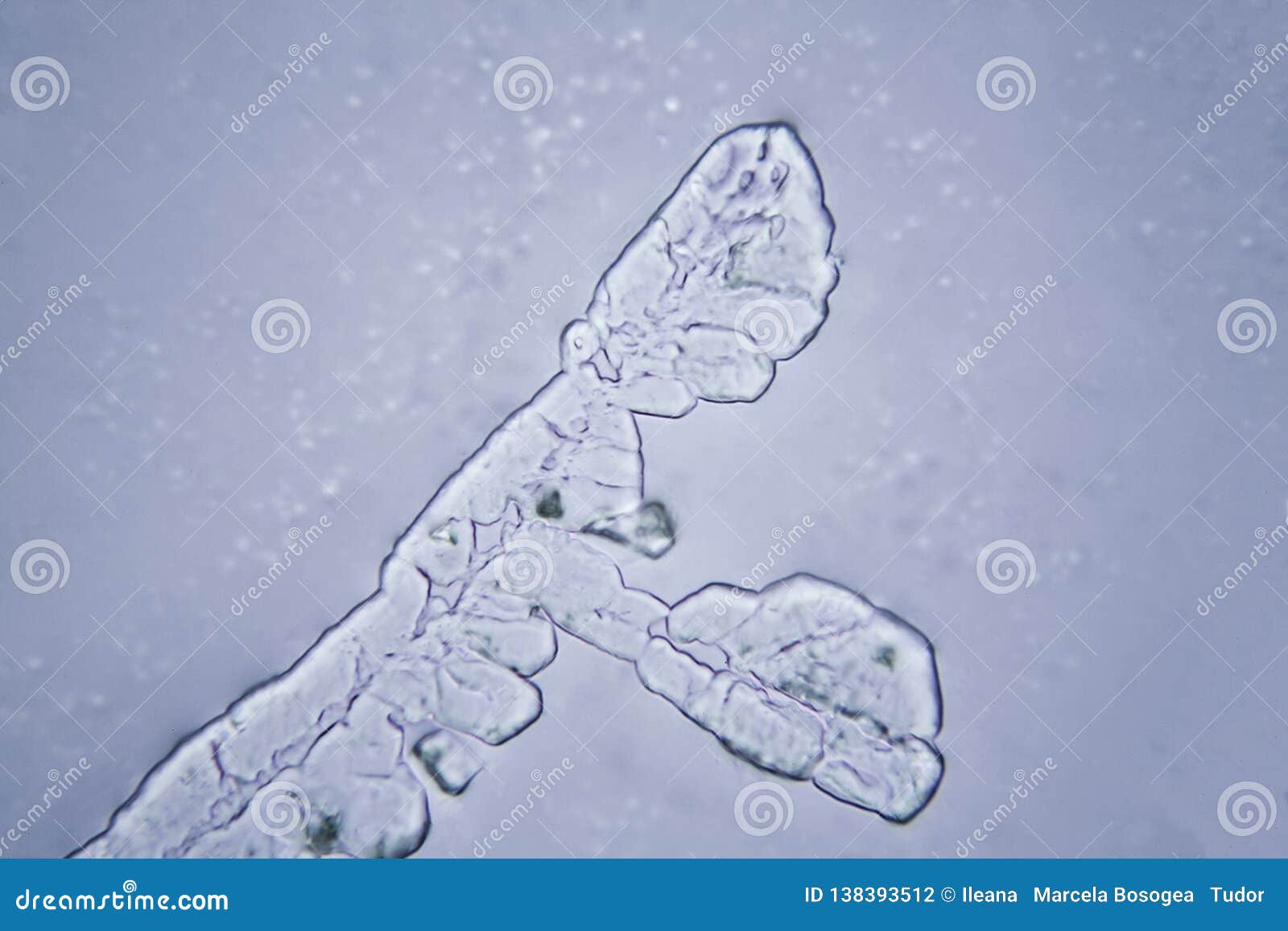 Tears Viewed at the Microscope Stock Photo - Image of viewed, white ...