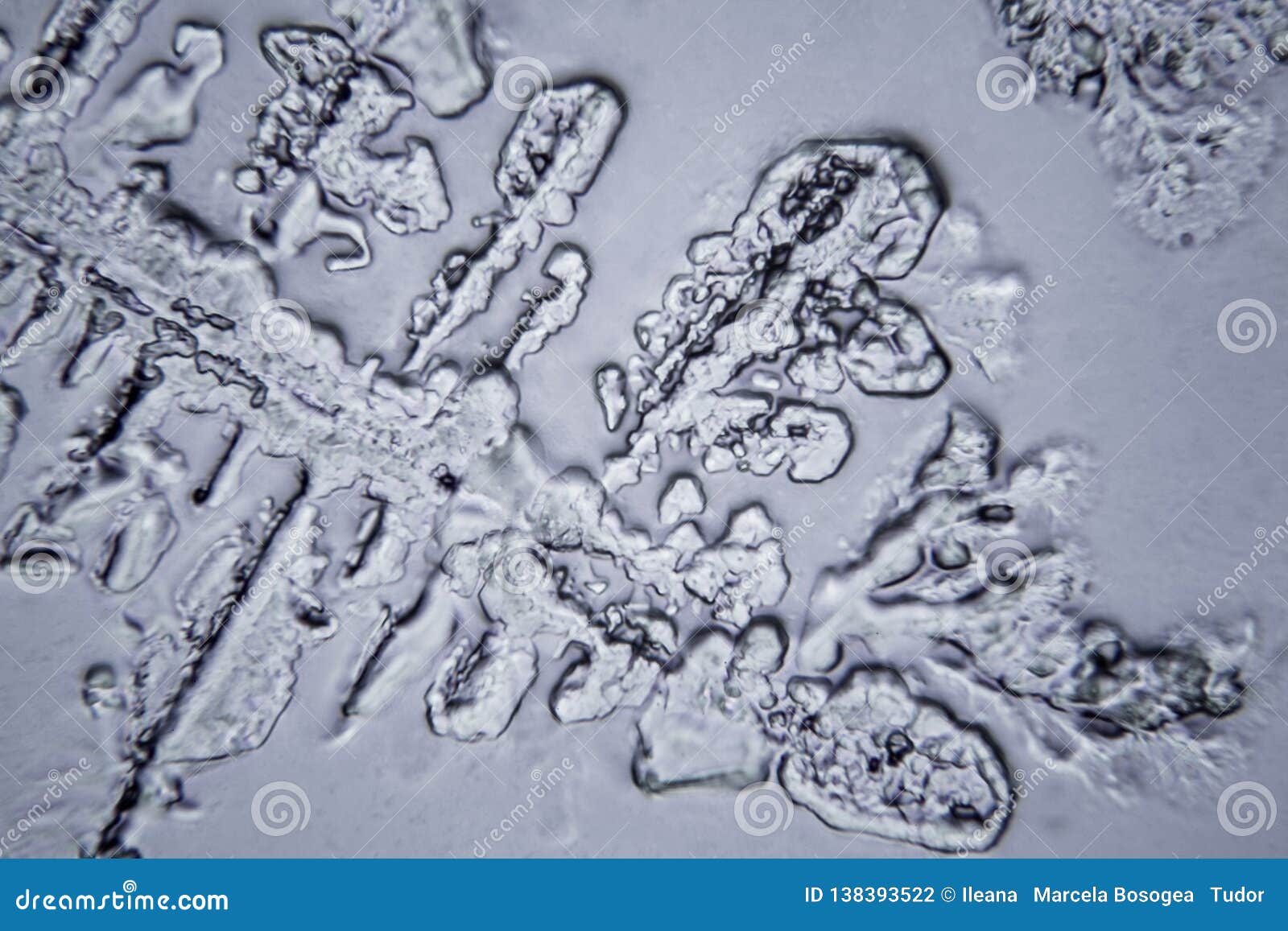 Tears Viewed at the Microscope Stock Photo - Image of human, loss ...