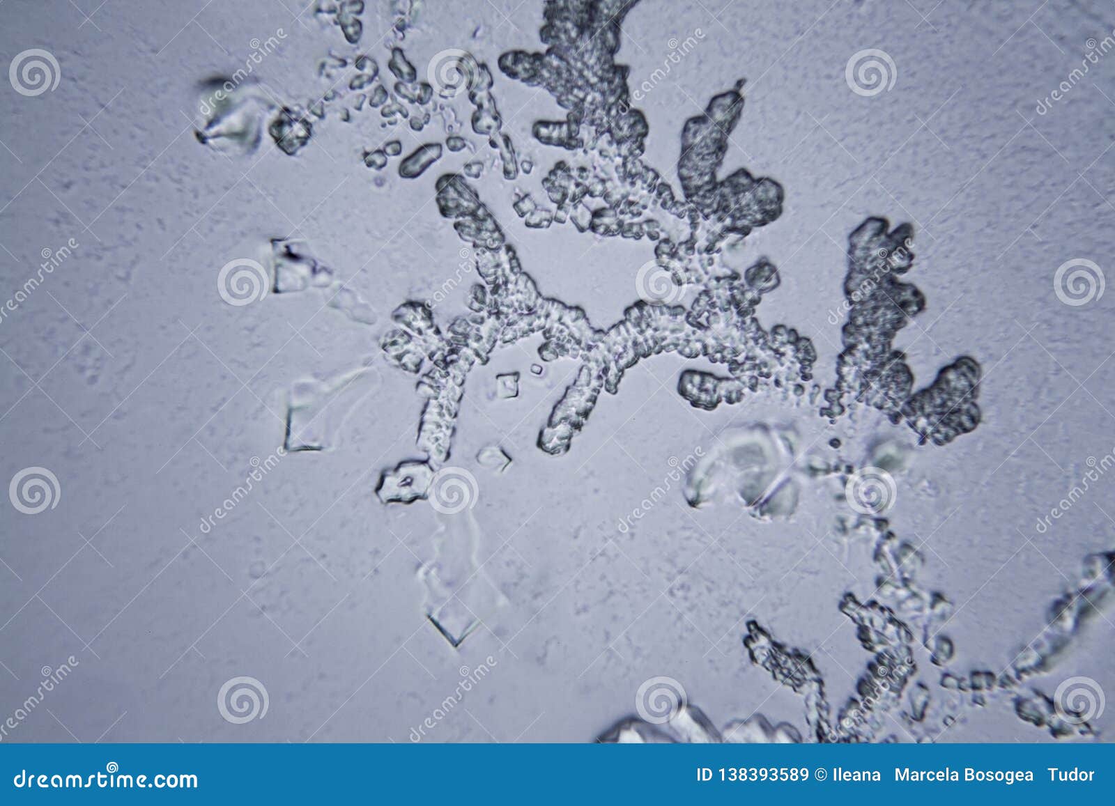 Tears Viewed at the Microscope Stock Image - Image of viewed, glass ...