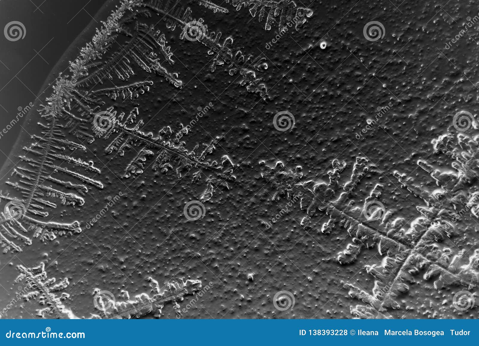 Tears Viewed at the Microscope Stock Photo - Image of laboratory ...