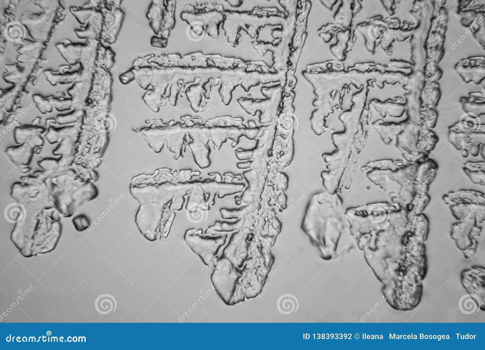 Tears Viewed at the Microscope Stock Photo - Image of human, slide ...