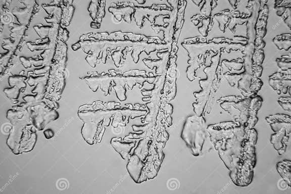 Tears Viewed at the Microscope Stock Photo - Image of human, slide ...