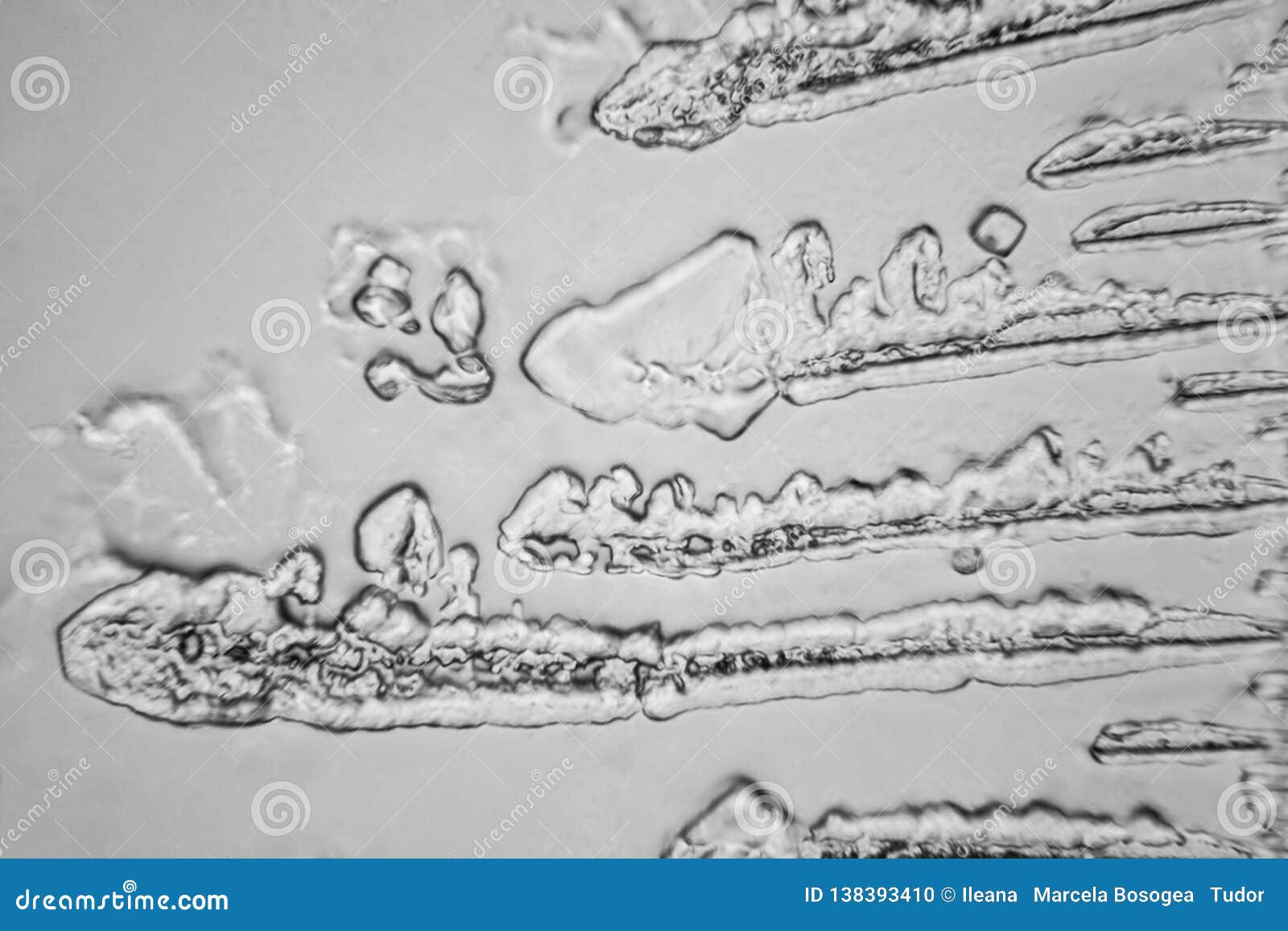 Tears Viewed at the Microscope Stock Photo - Image of human, technology ...