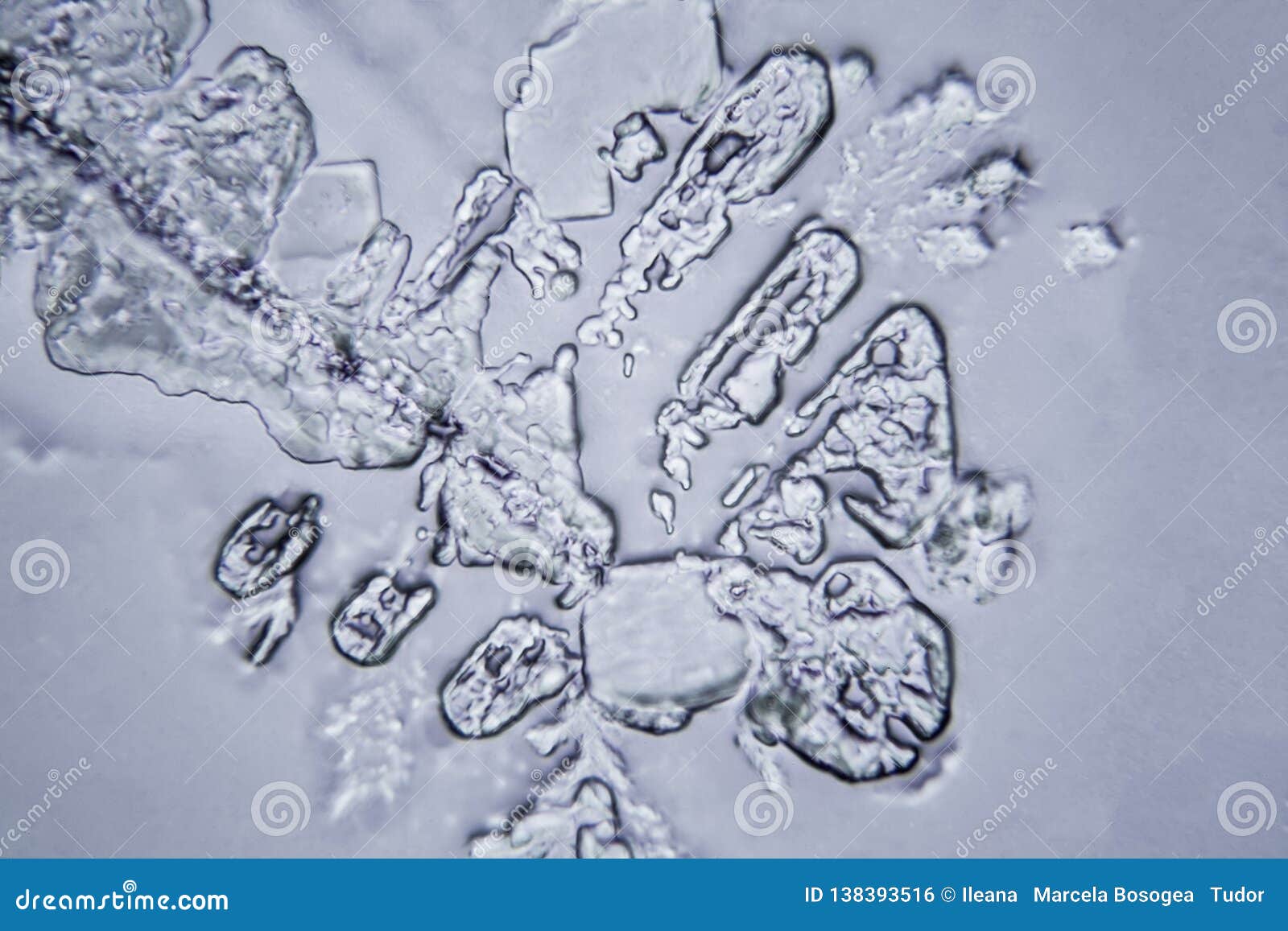 Tears Viewed at the Microscope Stock Photo - Image of cell, slide ...