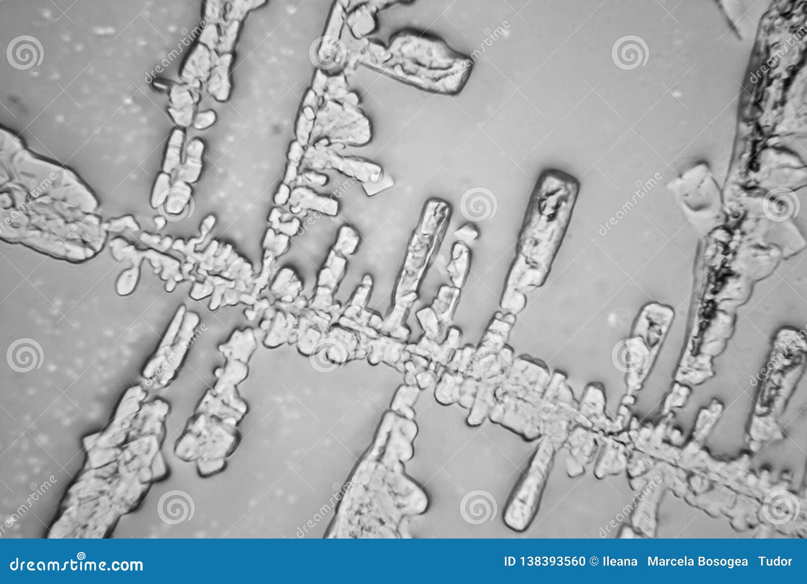 Tears Viewed at the Microscope Stock Photo - Image of sadness, viewed ...
