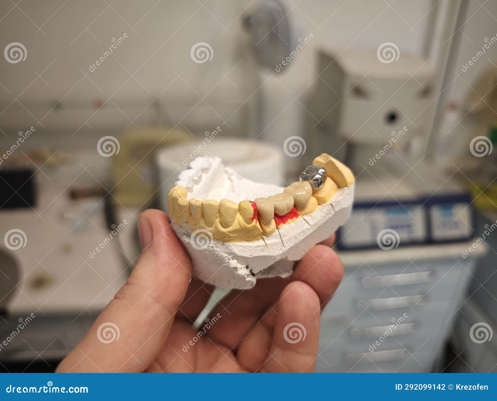 Technical Shots on a Dental Prothetic Laboratory Stock Photo - Image of ...