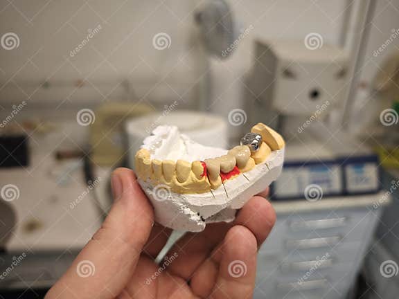 Technical Shots on a Dental Prothetic Laboratory Stock Photo - Image of ...