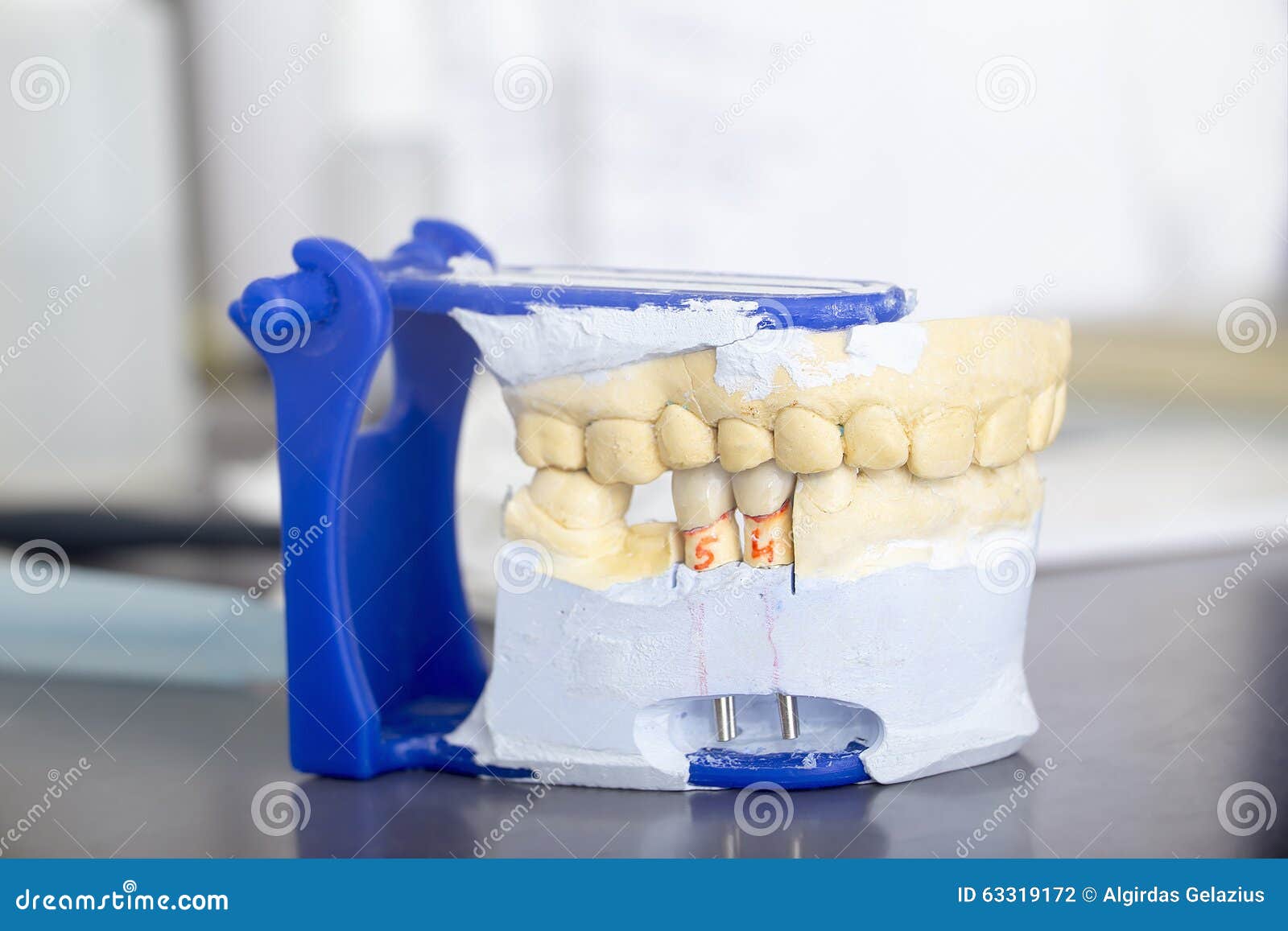Technical Shots on a Dental Prothetic Laboratory Stock Photo - Image of ...