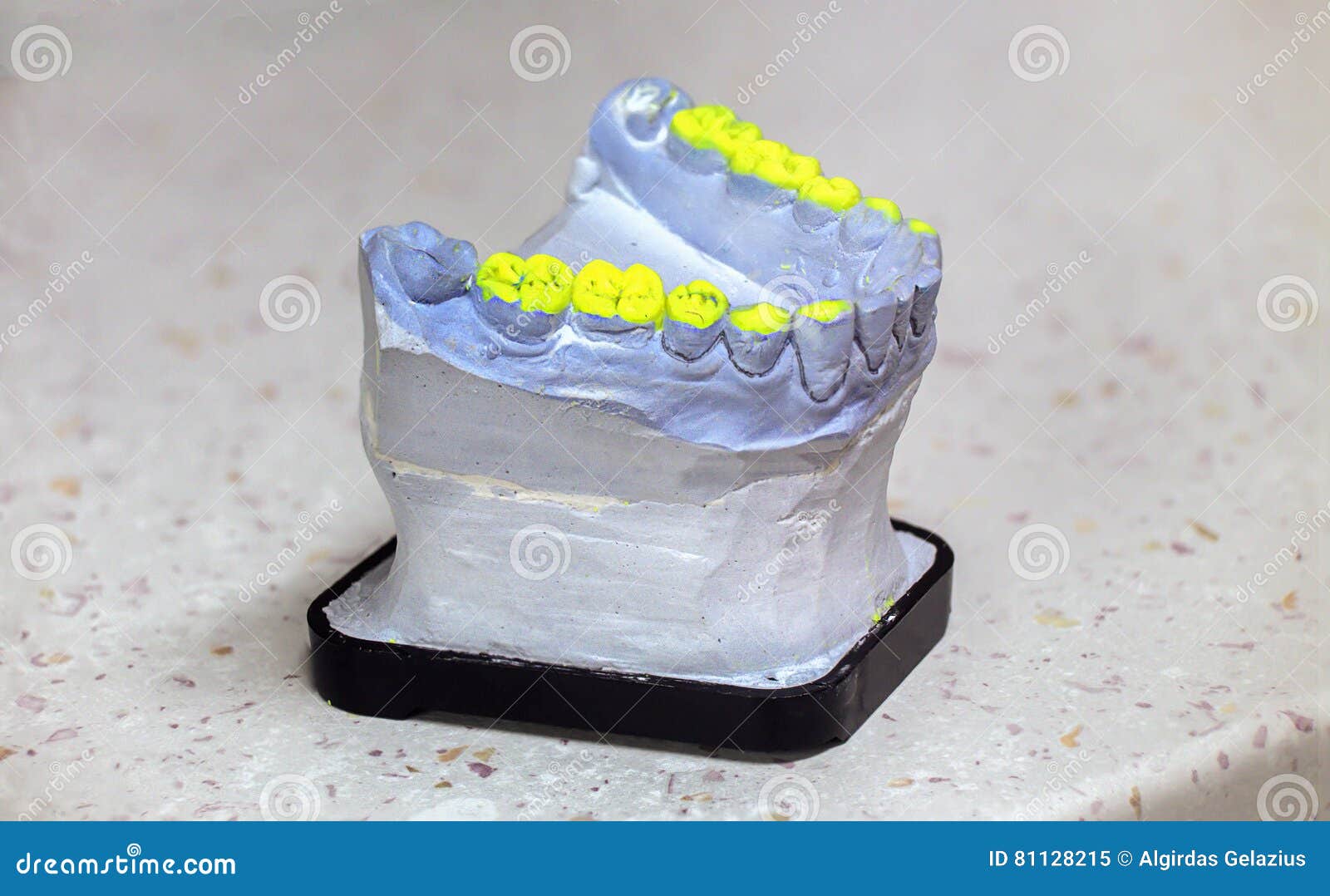 Technical Shots on a Dental Prothetic Laboratory Stock Image - Image of ...