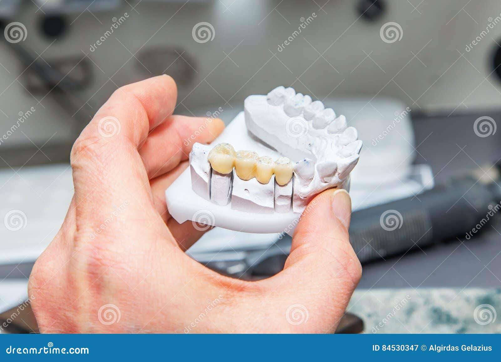 Technical Shots on a Dental Prothetic Laboratory Stock Image - Image of ...